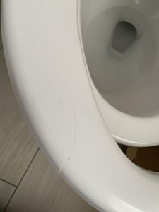 Fix a Broken Bidet Toilet Seat With Potential Design Flaw : 4 Steps ...