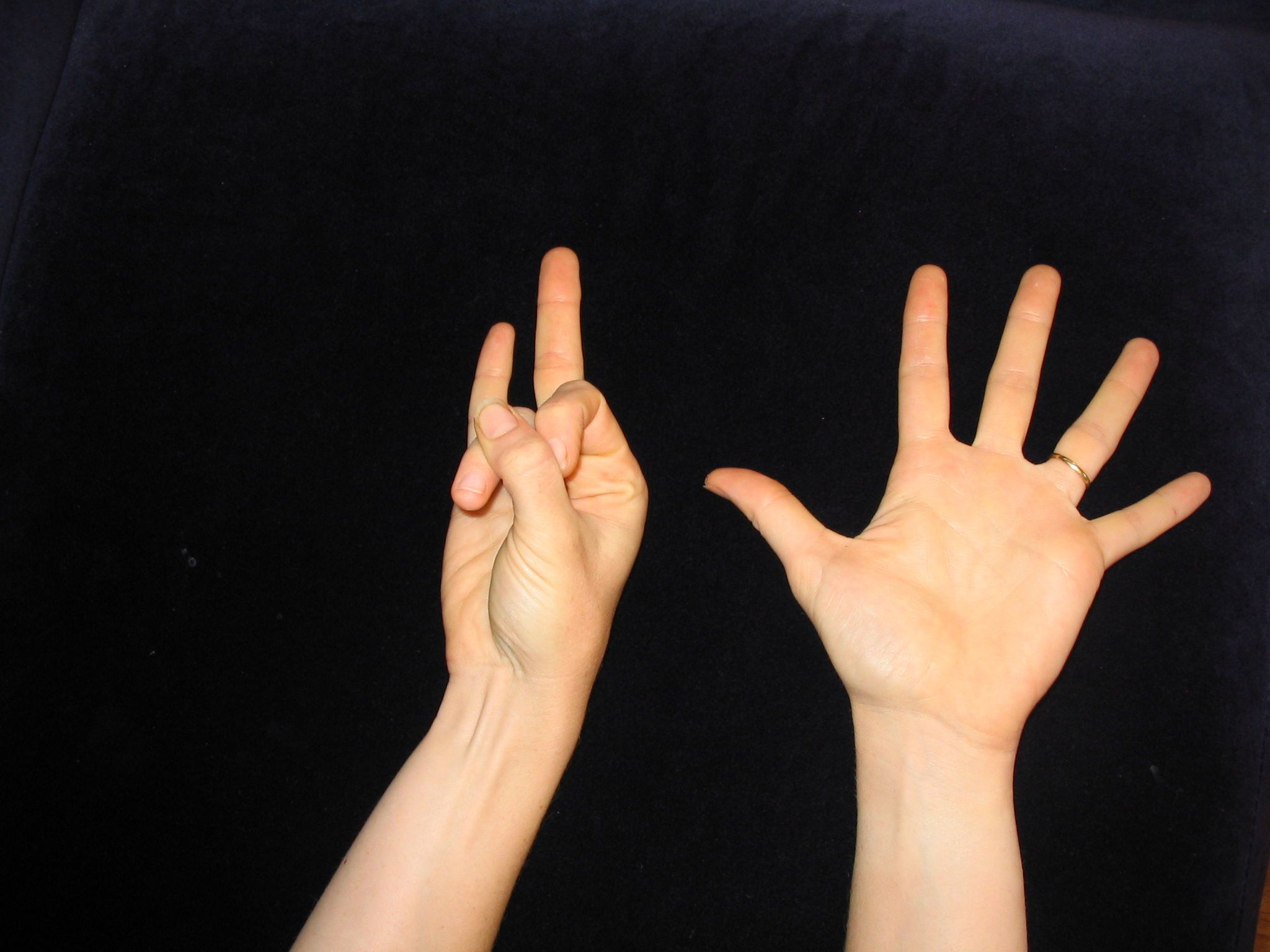 Mouse Toe Numbering Scheme : 5 Steps - Instructables