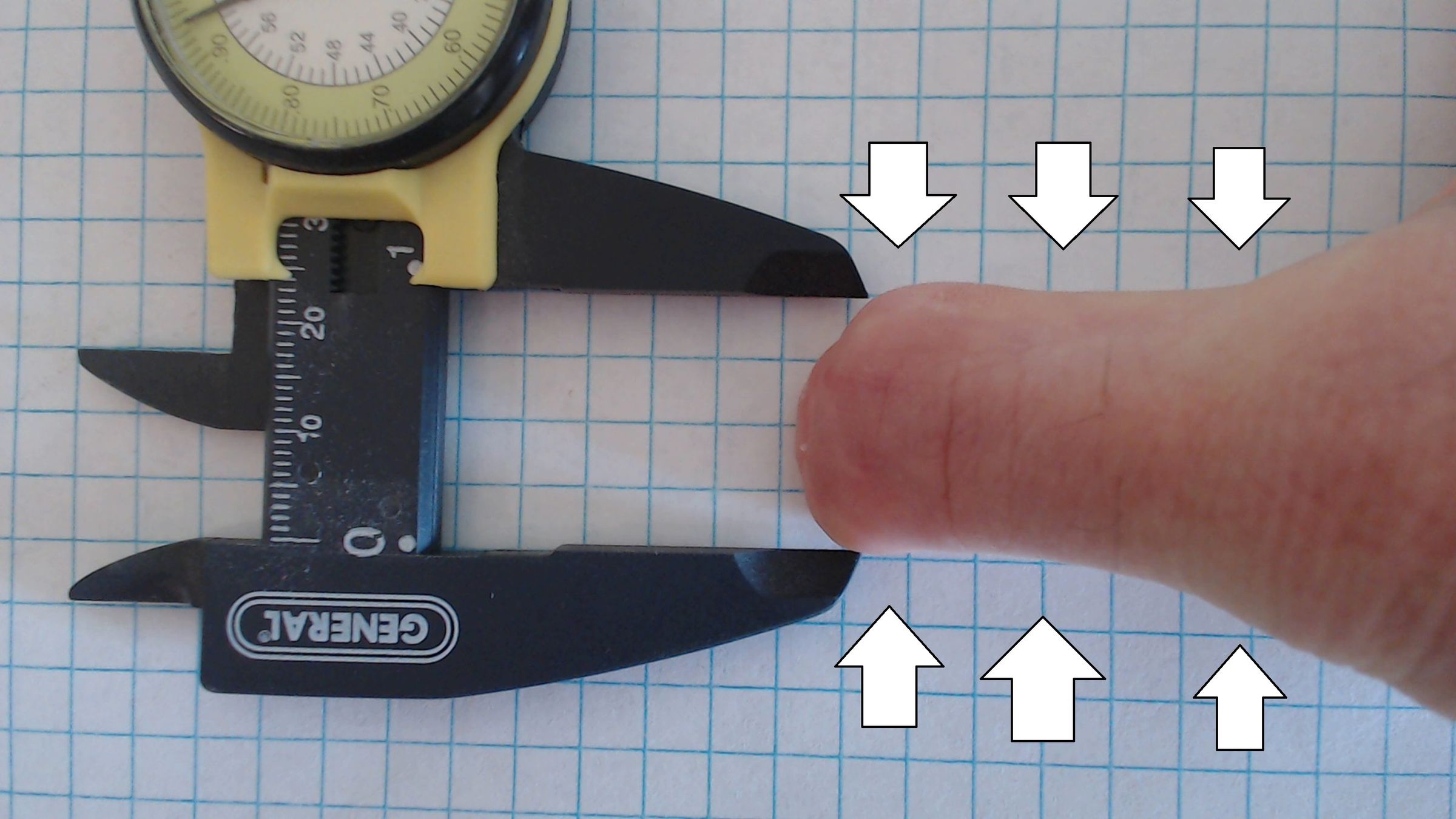 Thumb Prosthesis : 12 Steps (with Pictures) - Instructables