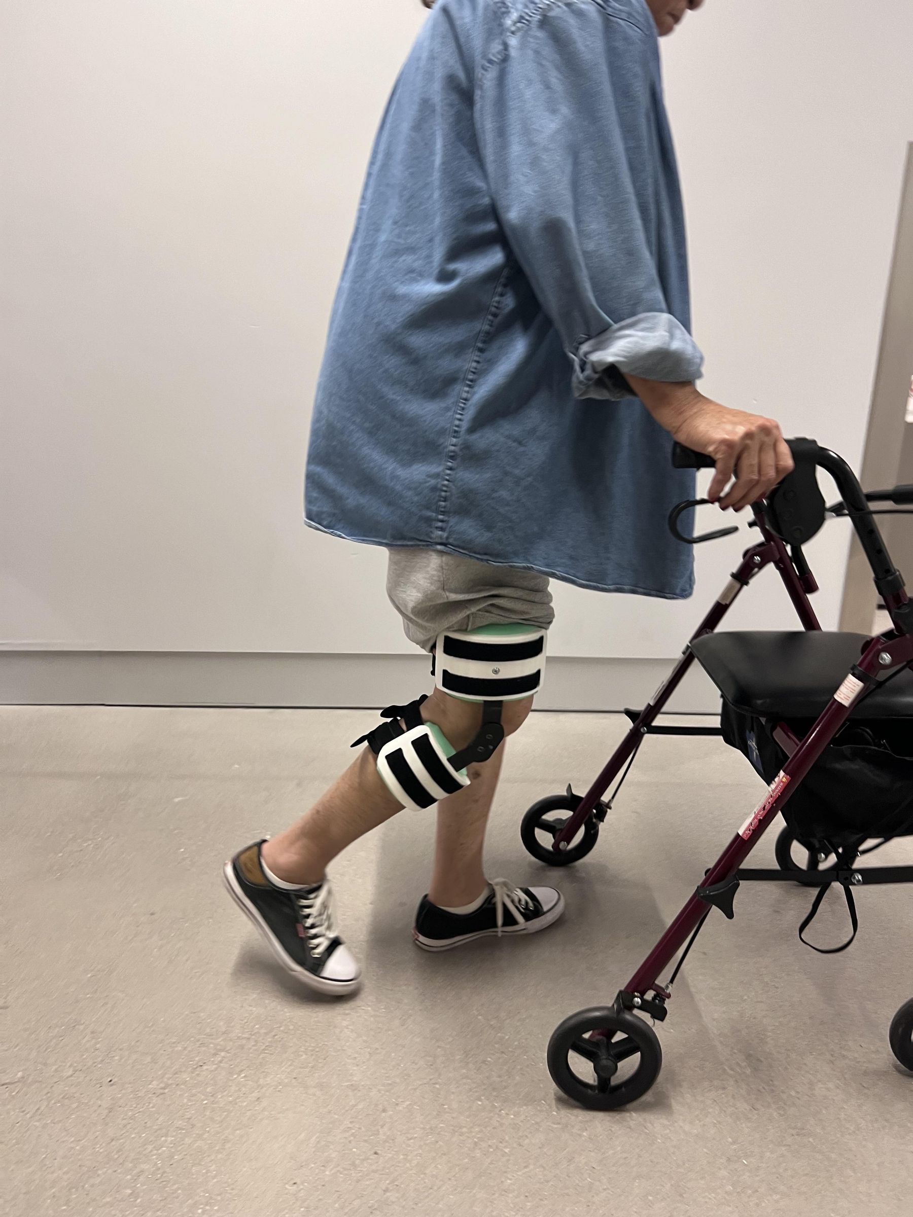 Custom 3D Printed Anti-Slip Knee Brace : 9 Steps - Instructables