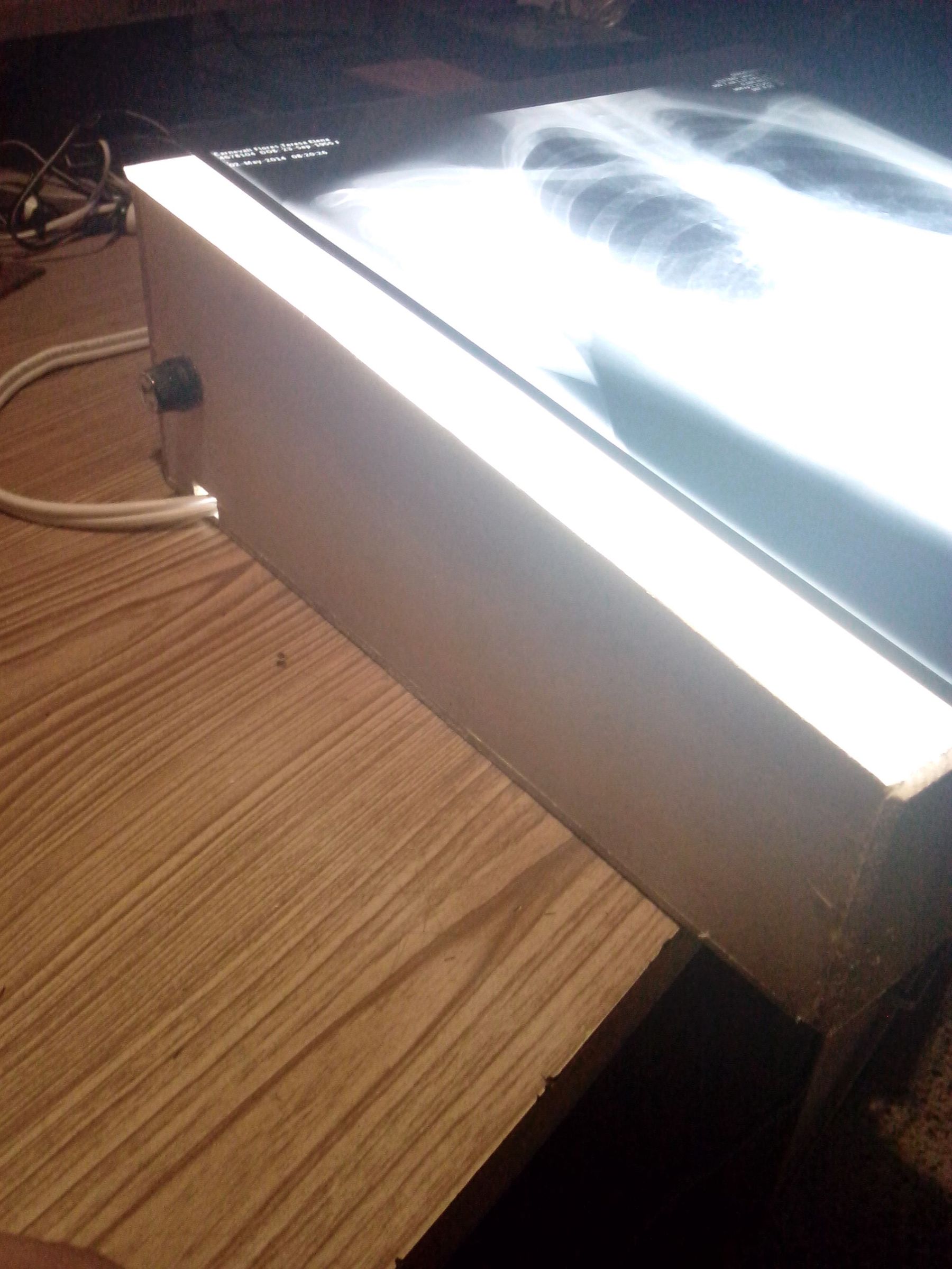 DIY Negatoscope (with Pictures) - Instructables
