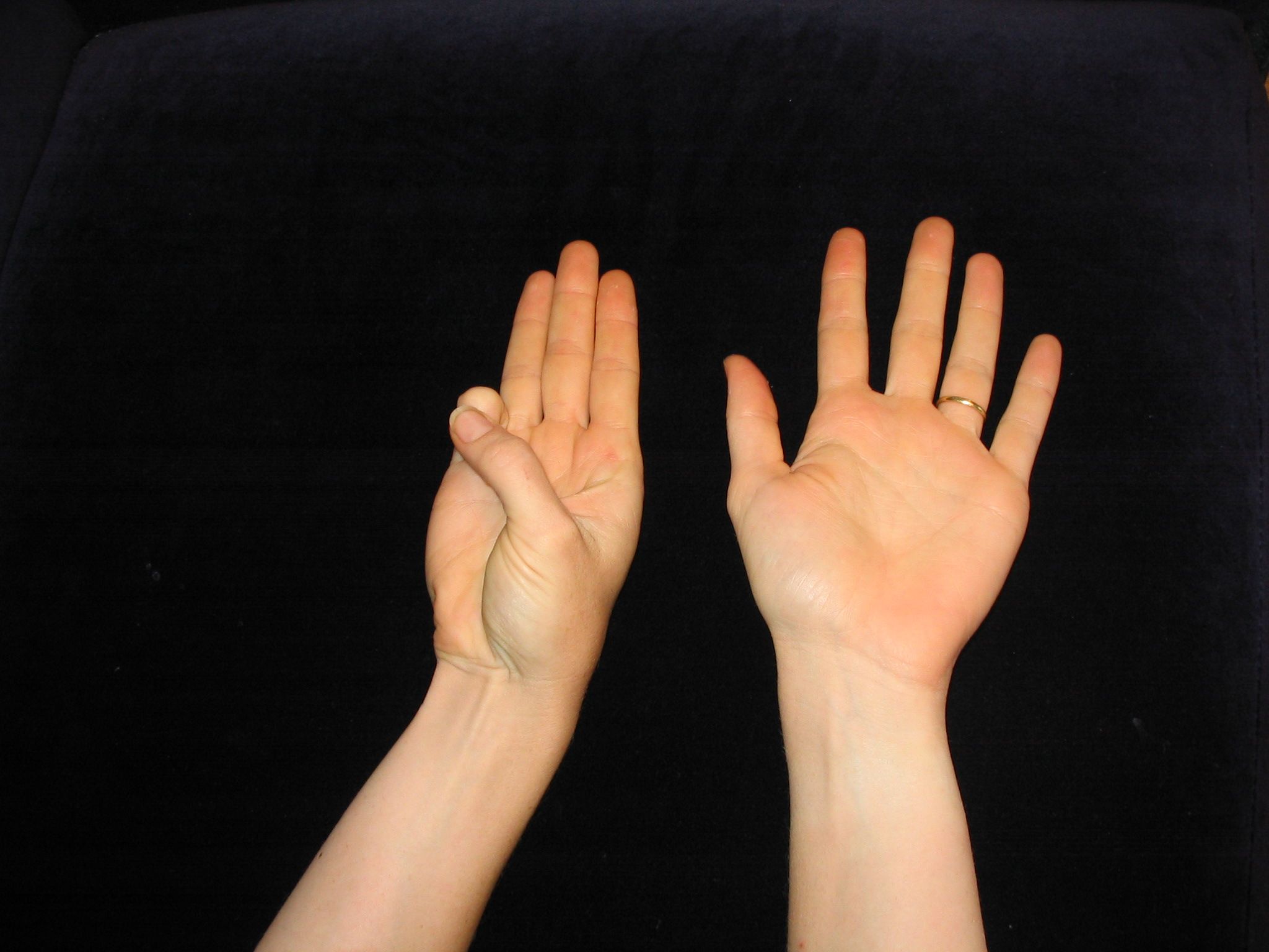 Mouse Toe Numbering Scheme : 5 Steps - Instructables