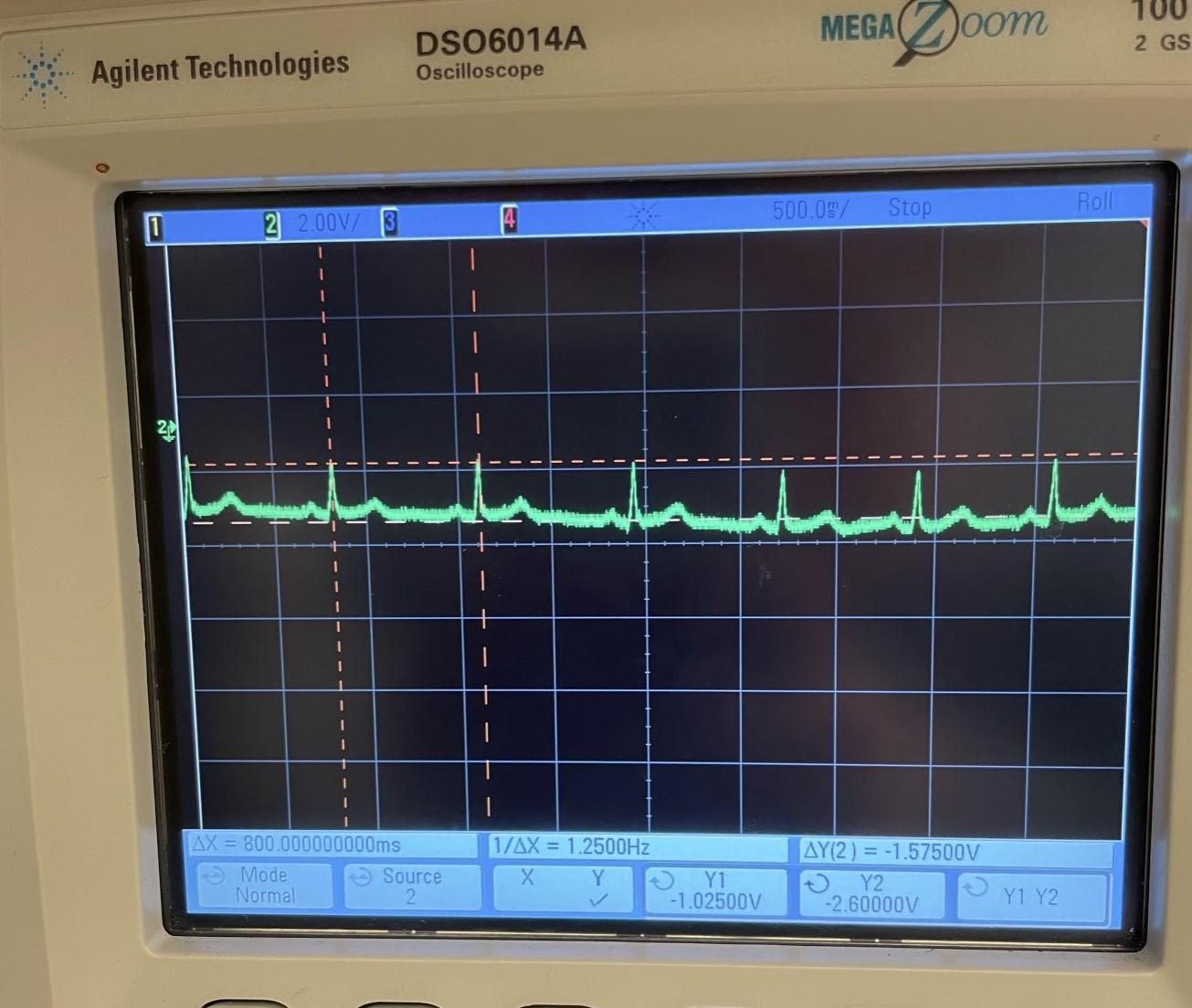 Integrated Human ECG : 4 Steps - Instructables