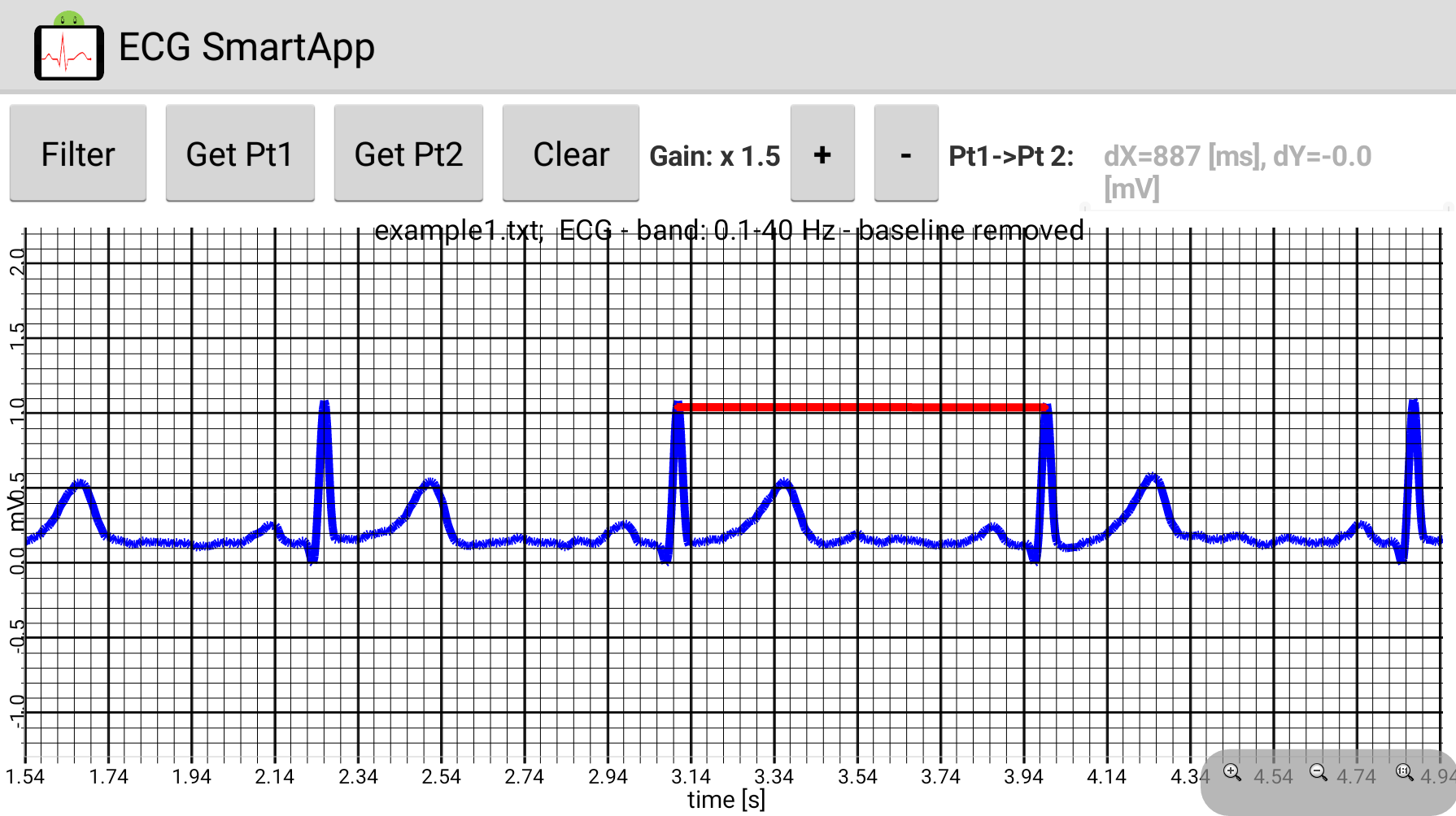 How to Build a Low Cost ECG Device : 27 Steps - Instructables