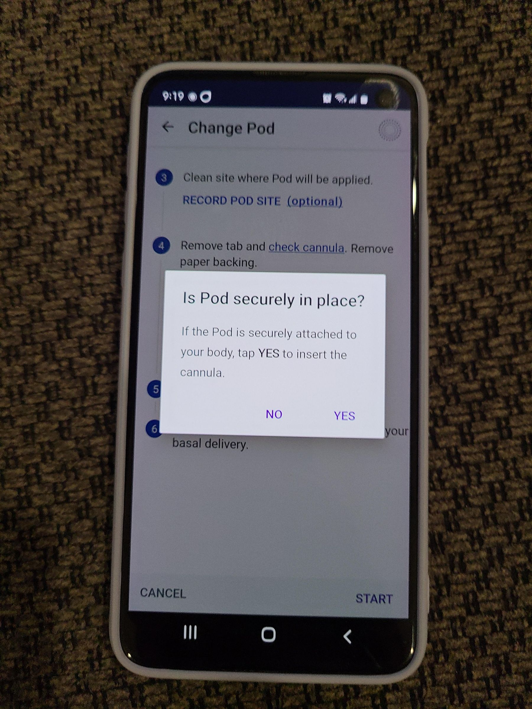 How to Use an Omnipod 5 : 6 Steps - Instructables