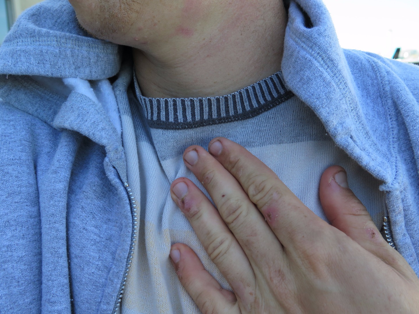 Heart Dissection : 8 Steps (with Pictures) - Instructables