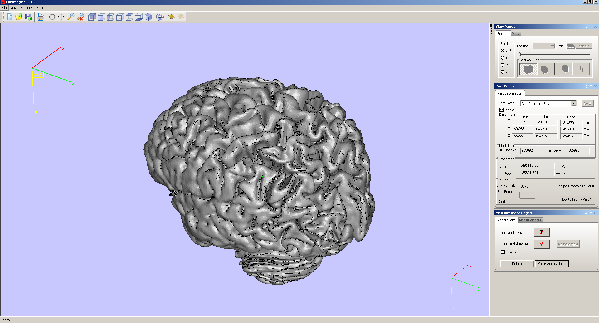 Edible Chocolate Brain From MRI Scan : 9 Steps (with Pictures ...