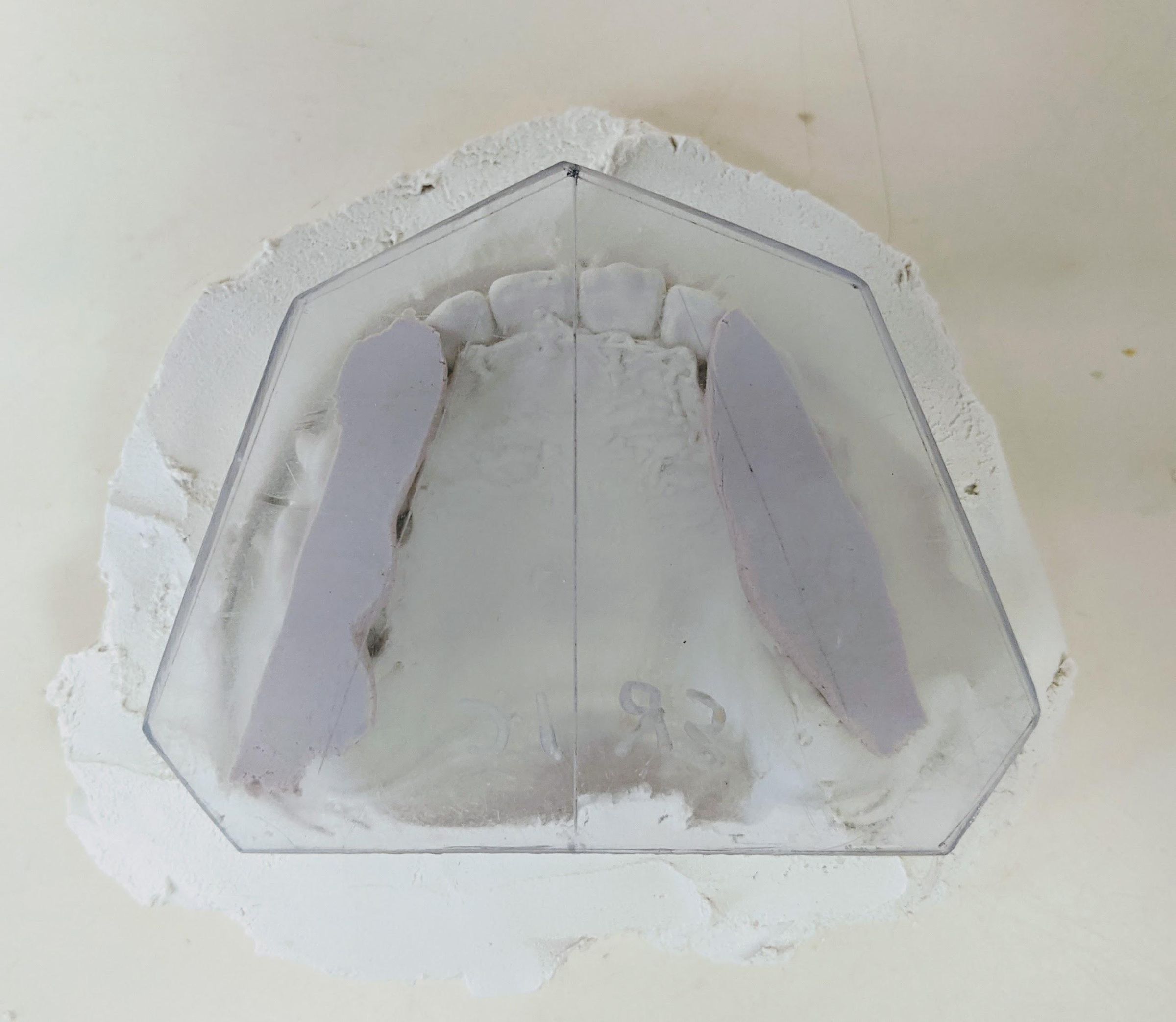 A New Method for Trimming Orthodontic Study Model : 8 Steps - Instructables