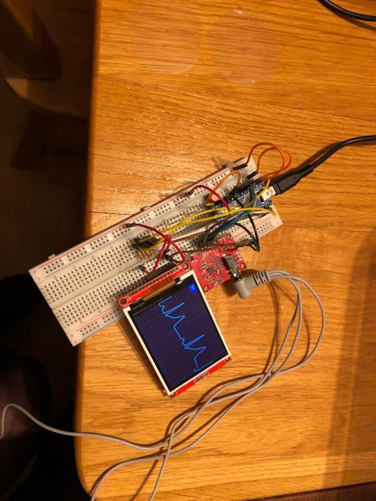 Ecg Display With Arduino : 13 Steps (with Pictures) - Instructables