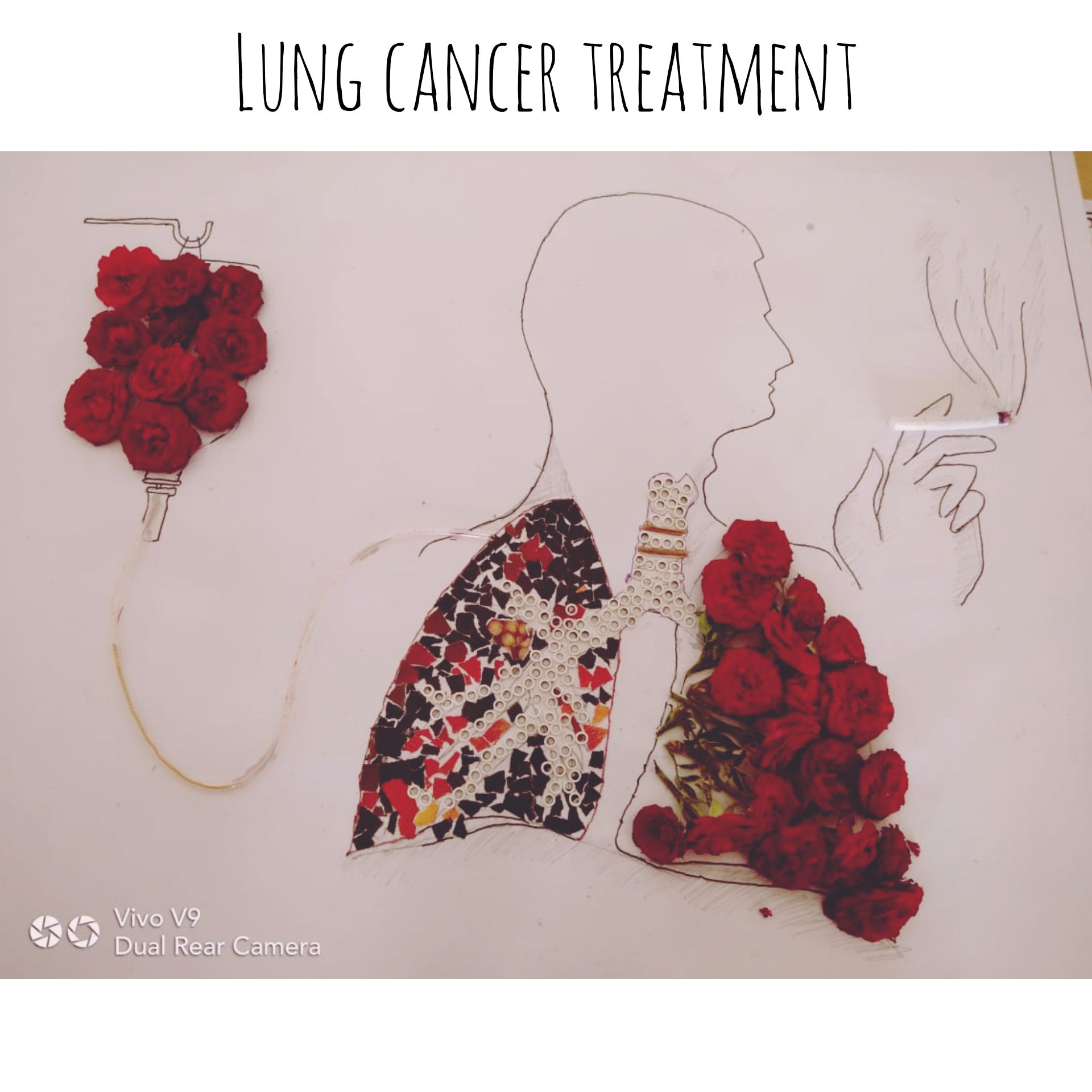 Lung Cancer Treatment - Collage Art : 3 Steps - Instructables