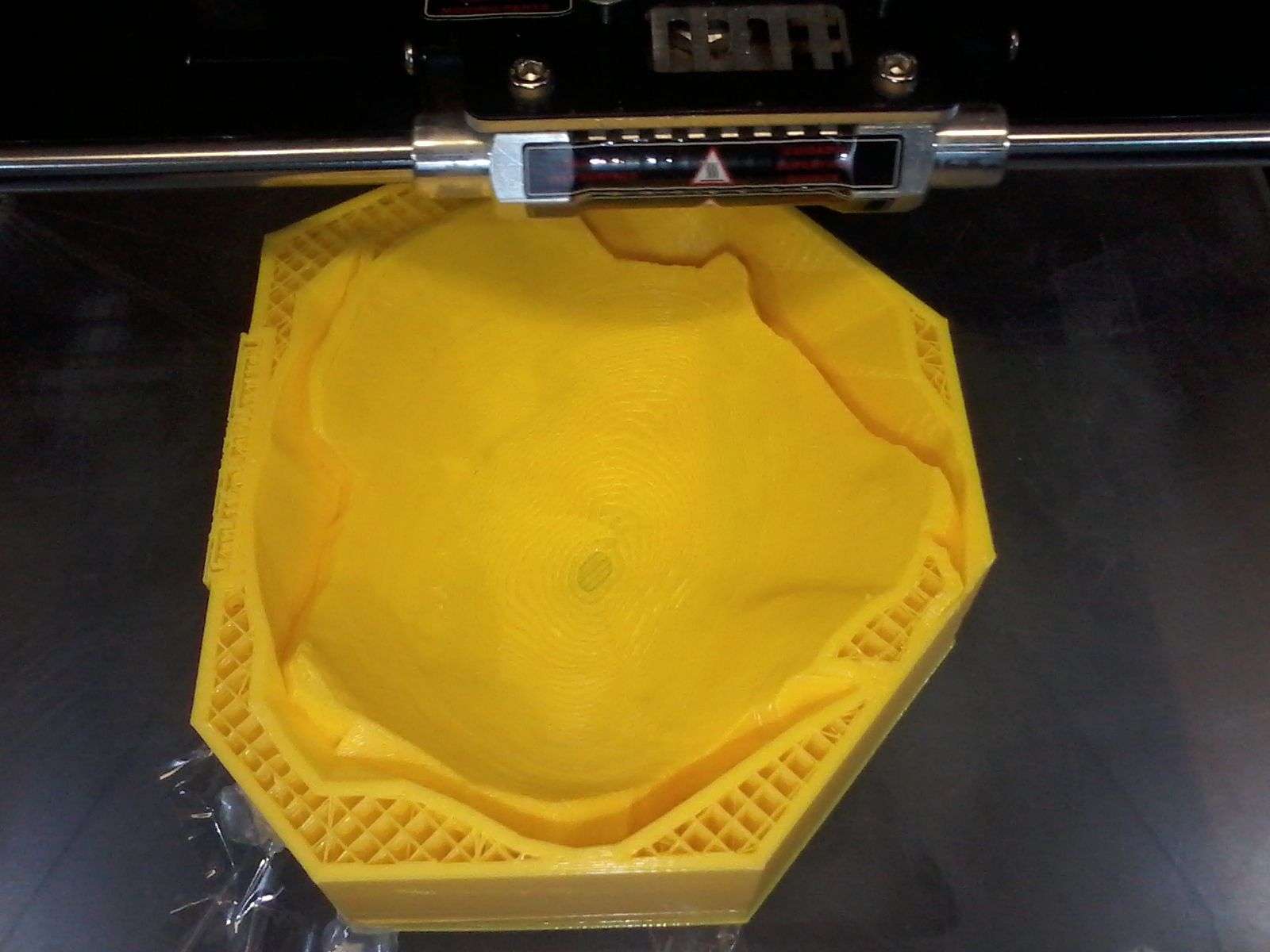 Surgery + Fully 3D Printed Mold : 7 Steps (with Pictures) - Instructables