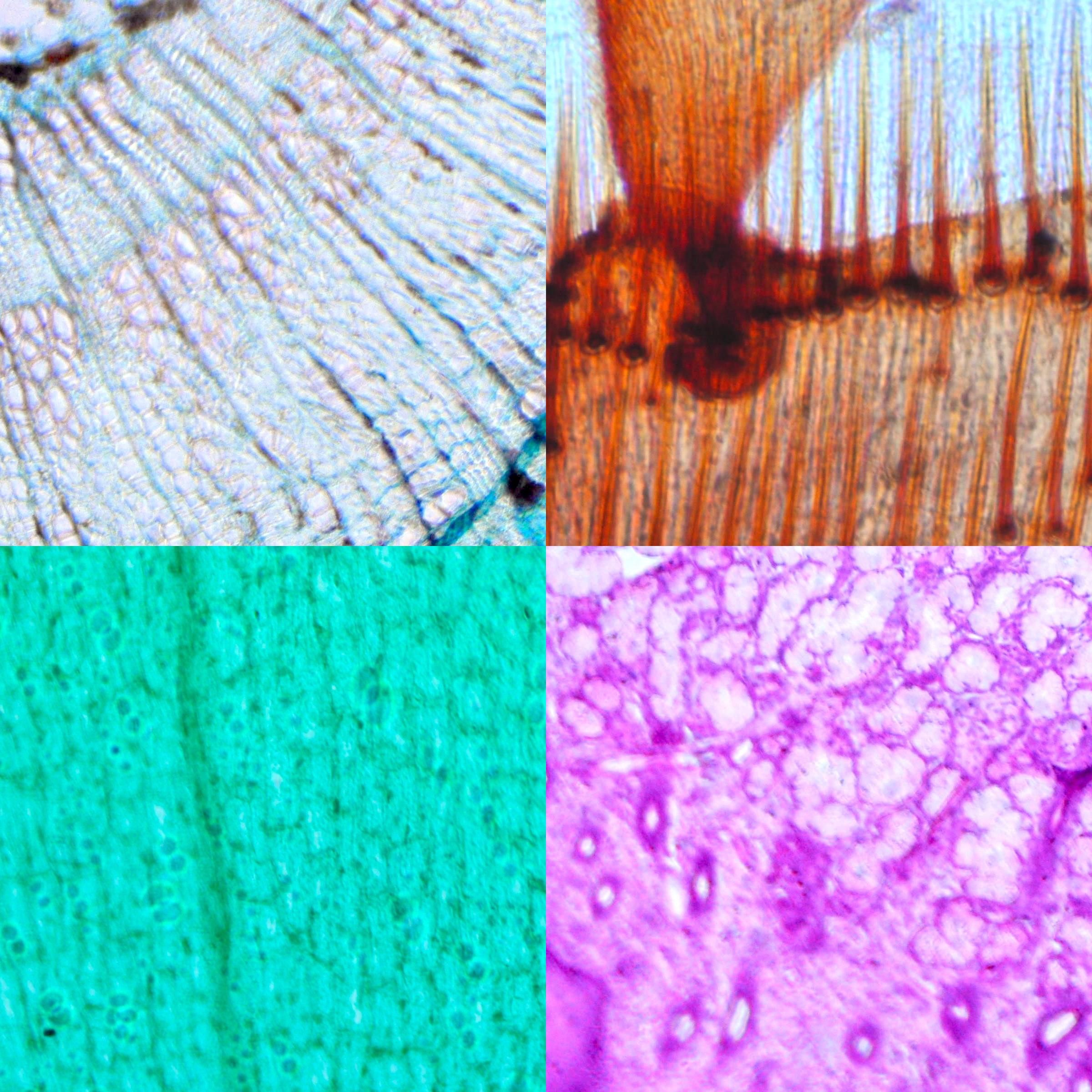 Low-cost Fluorescence and Brightfield Microscopes : 9 Steps (with ...