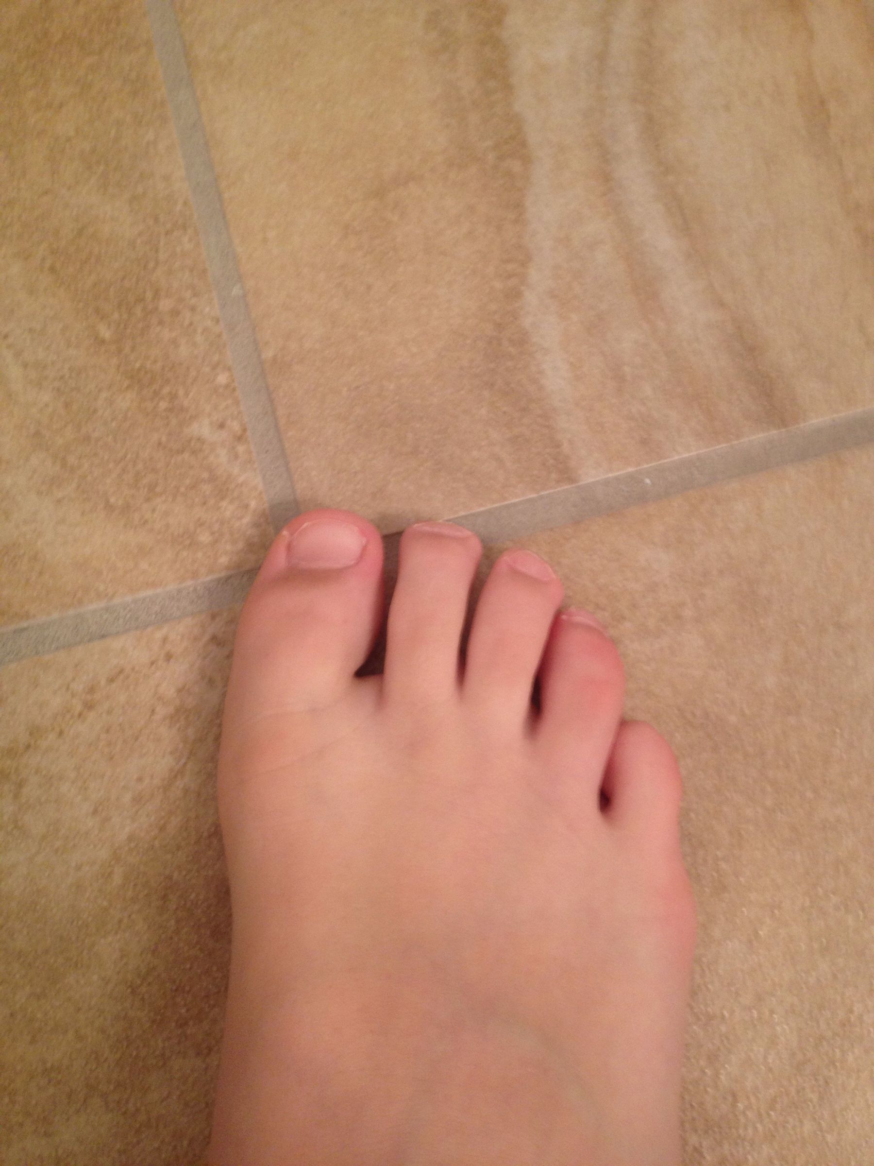 How to Cut Toe Nails LOL : 3 Steps - Instructables