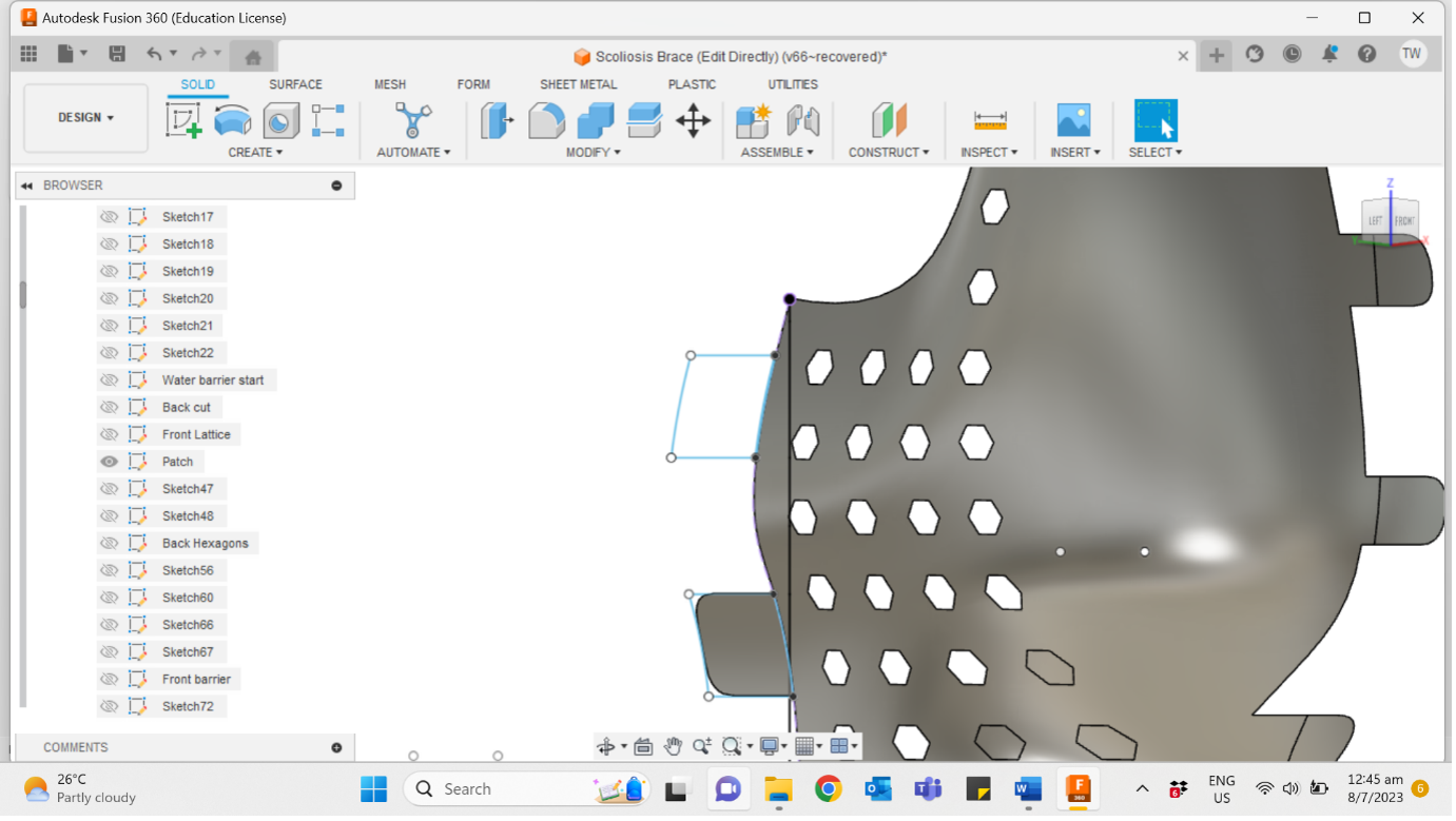 3D Printed Back Brace for Scoliosis : 7 Steps (with Pictures ...