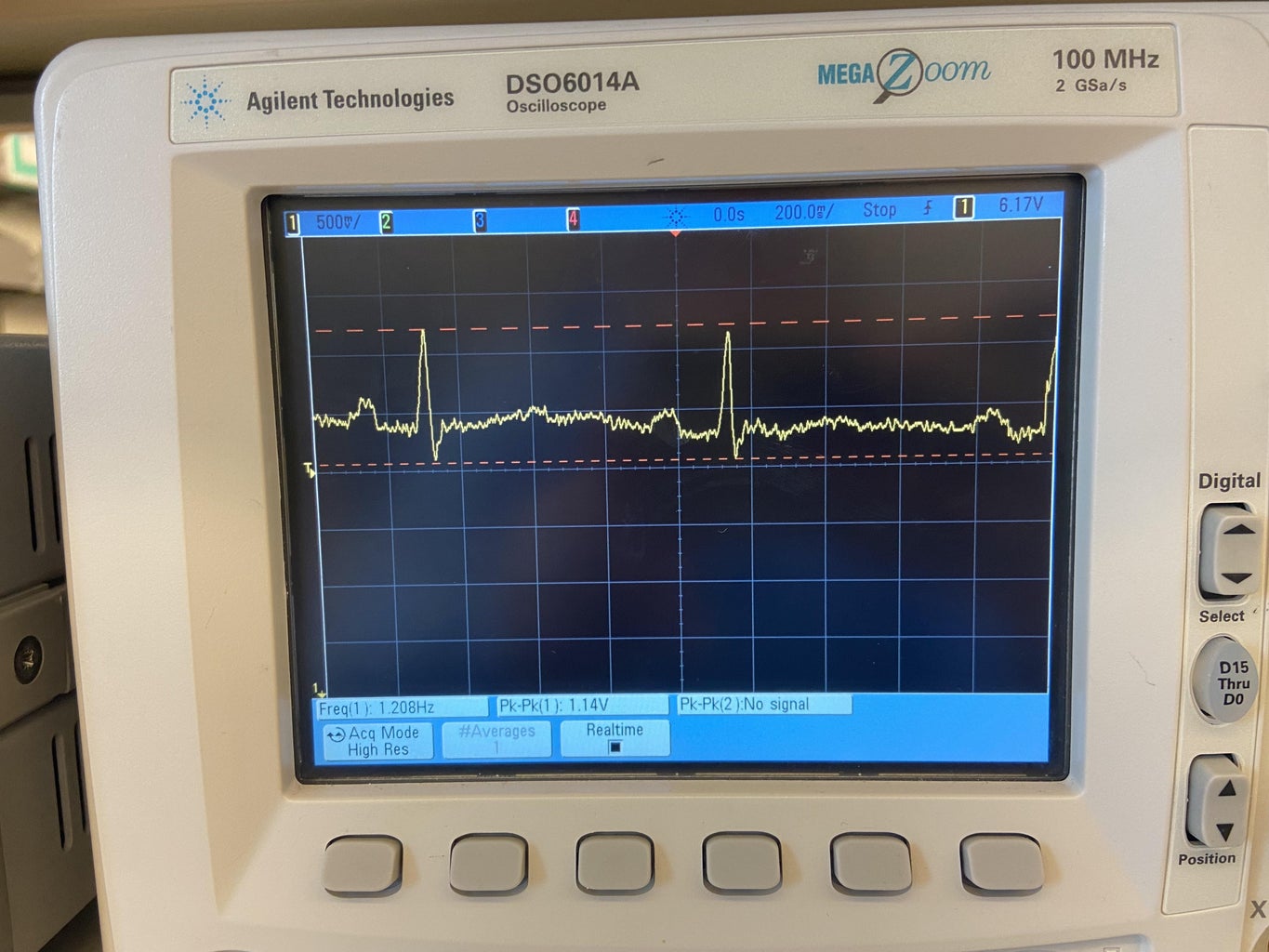 Design A Functional Ecg With Automated Plotting Of The Biosignal 6 Steps Instructables