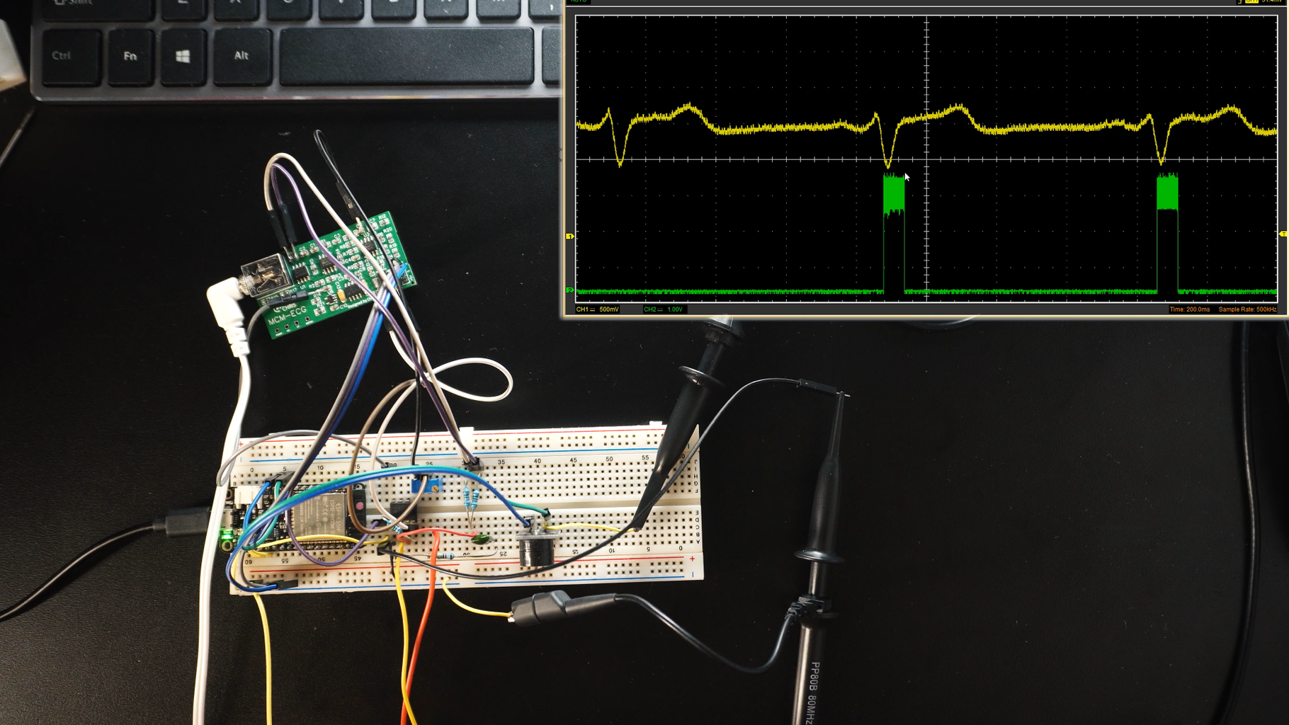Diy Ecg Heart Monitor Analog Interface Arduino 8 Steps