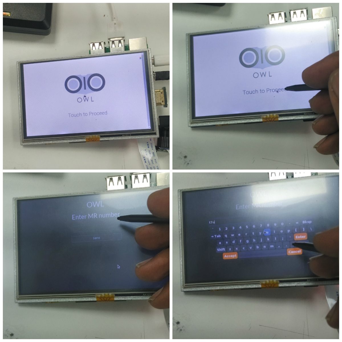 Open Indirect Ophthalmoscope (OIO) : 10 Steps (with Pictures ...