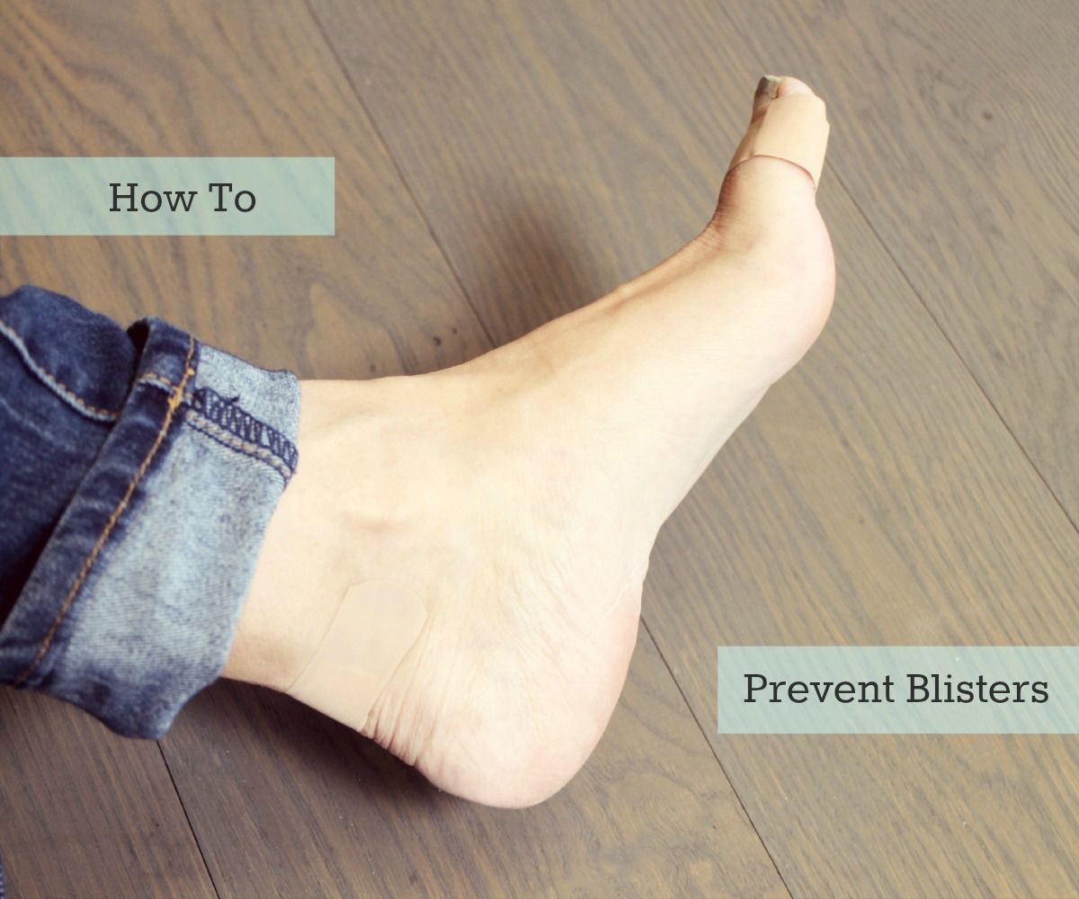 Prevent Blisters : 5 Steps (with Pictures) - Instructables