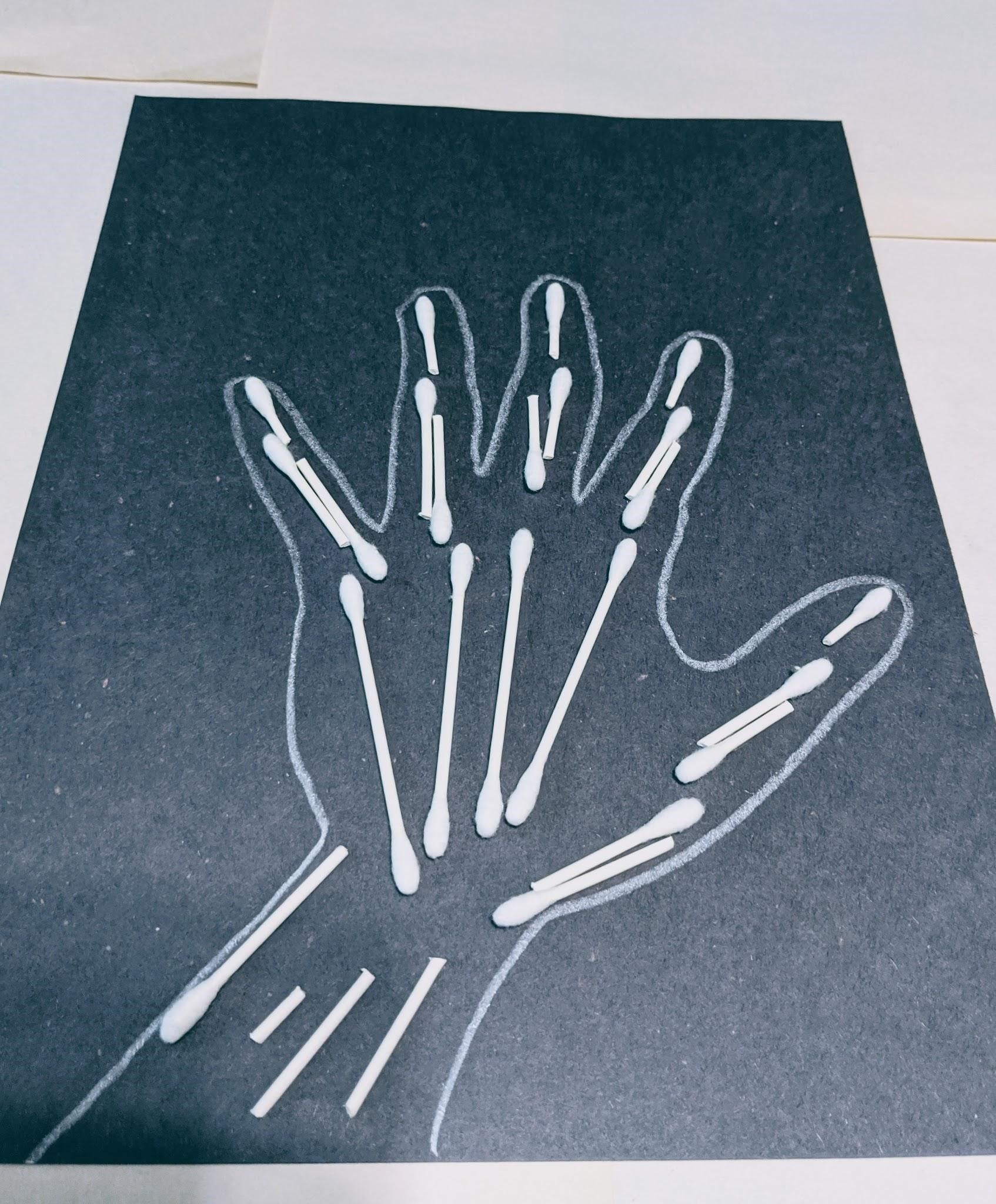 X Ray Hand Drawing