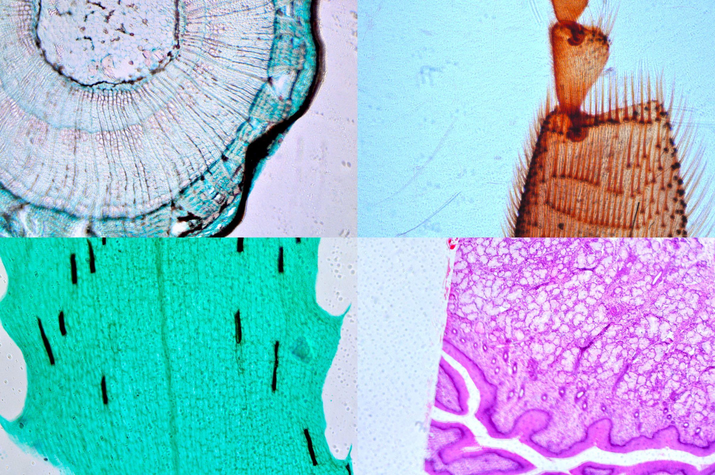 Low-cost Fluorescence and Brightfield Microscopes : 9 Steps (with ...