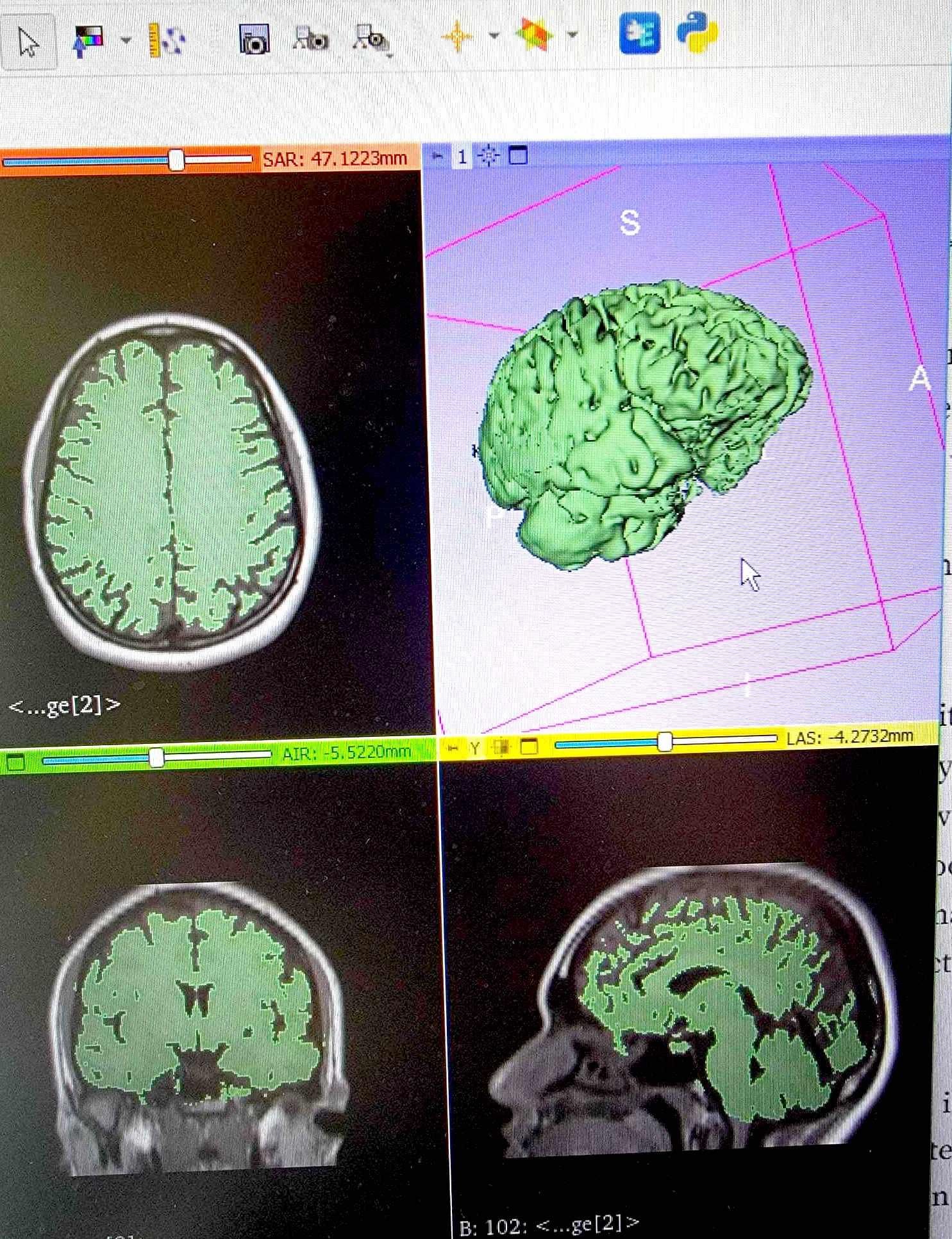 How To: From MRI to 3D Printed Brain Lamp : 4 Steps (with Pictures) - Instructables