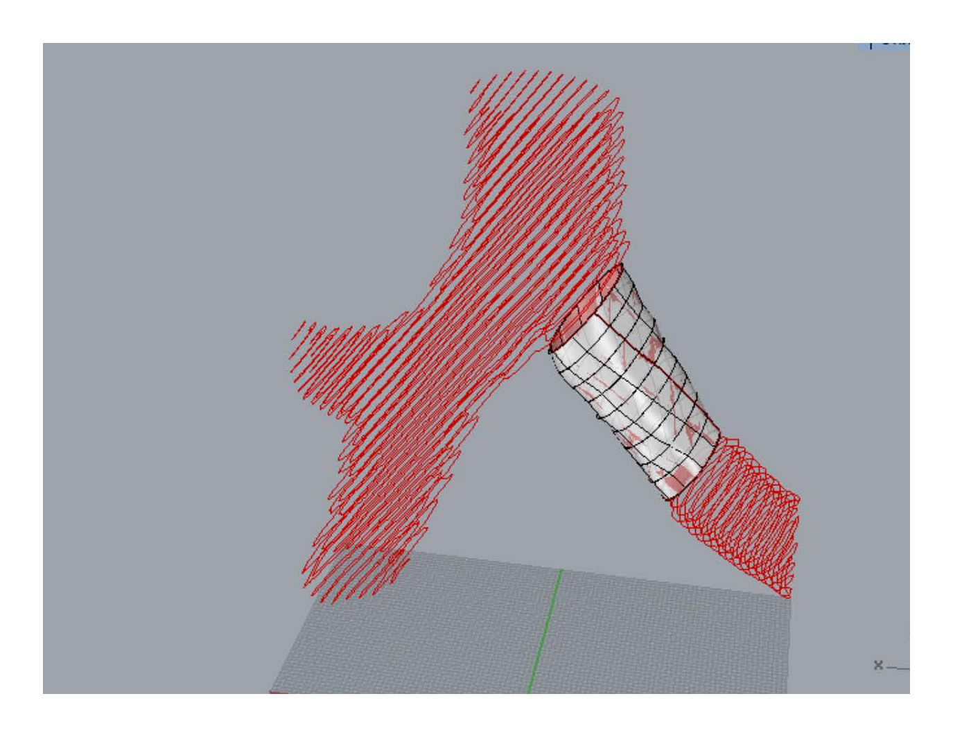Create a Custom 3D Printable Prosthetic Device Using Data From a CT ...