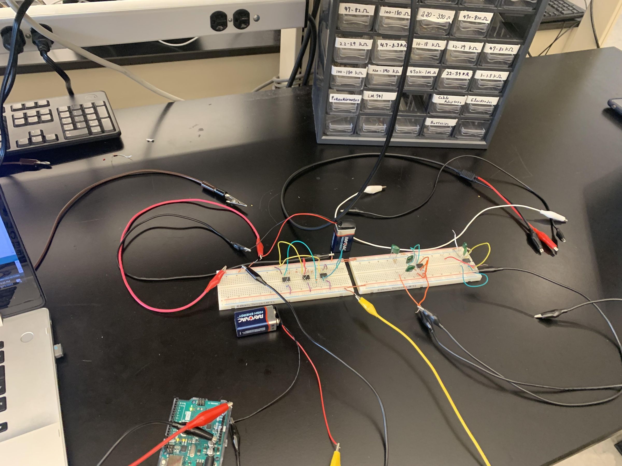 Functional ECG Circuit Design Project : 8 Steps - Instructables