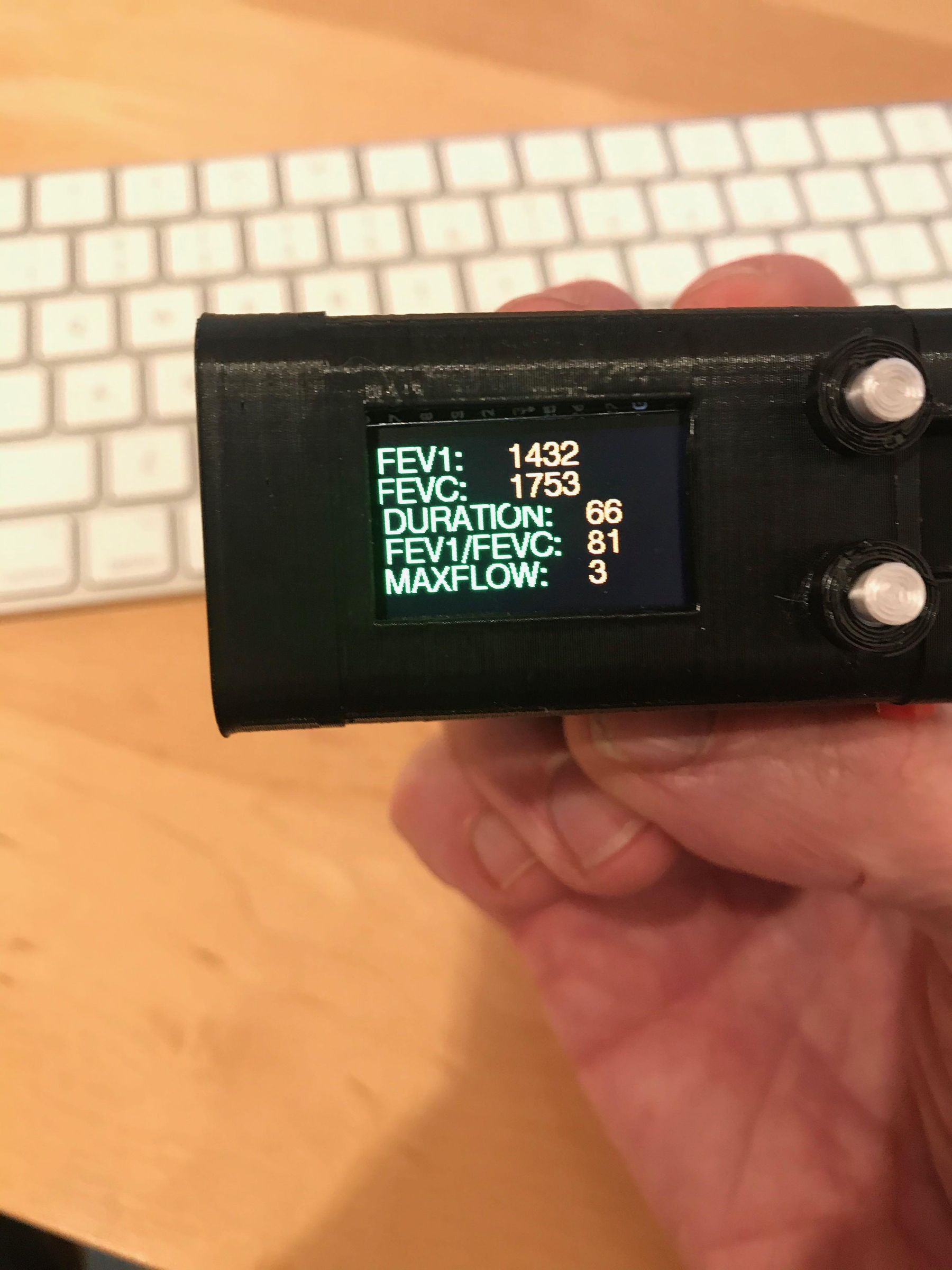 3D Printed Spirometer : 6 Steps (with Pictures) - Instructables