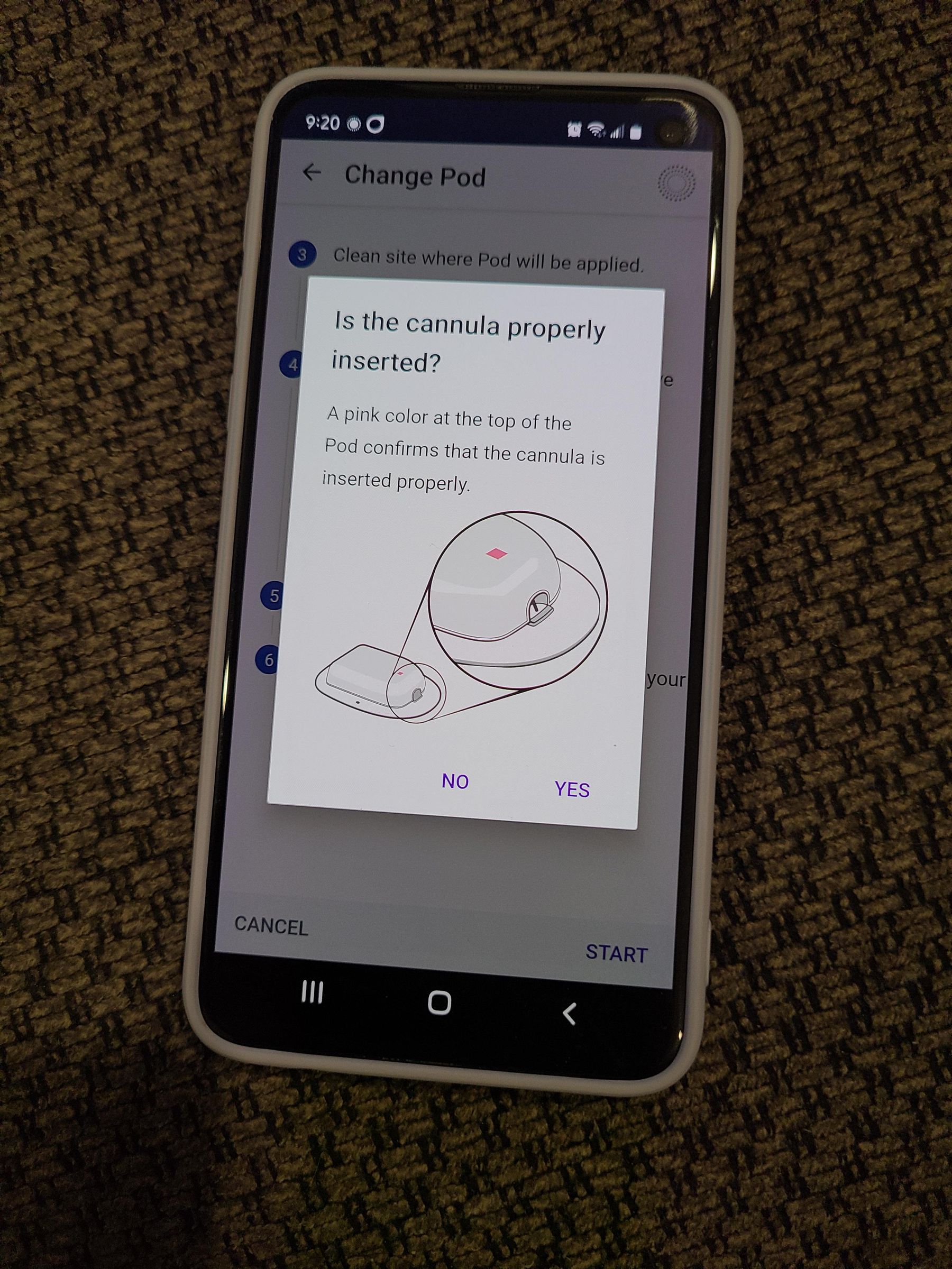 How to Use an Omnipod 5 : 6 Steps - Instructables