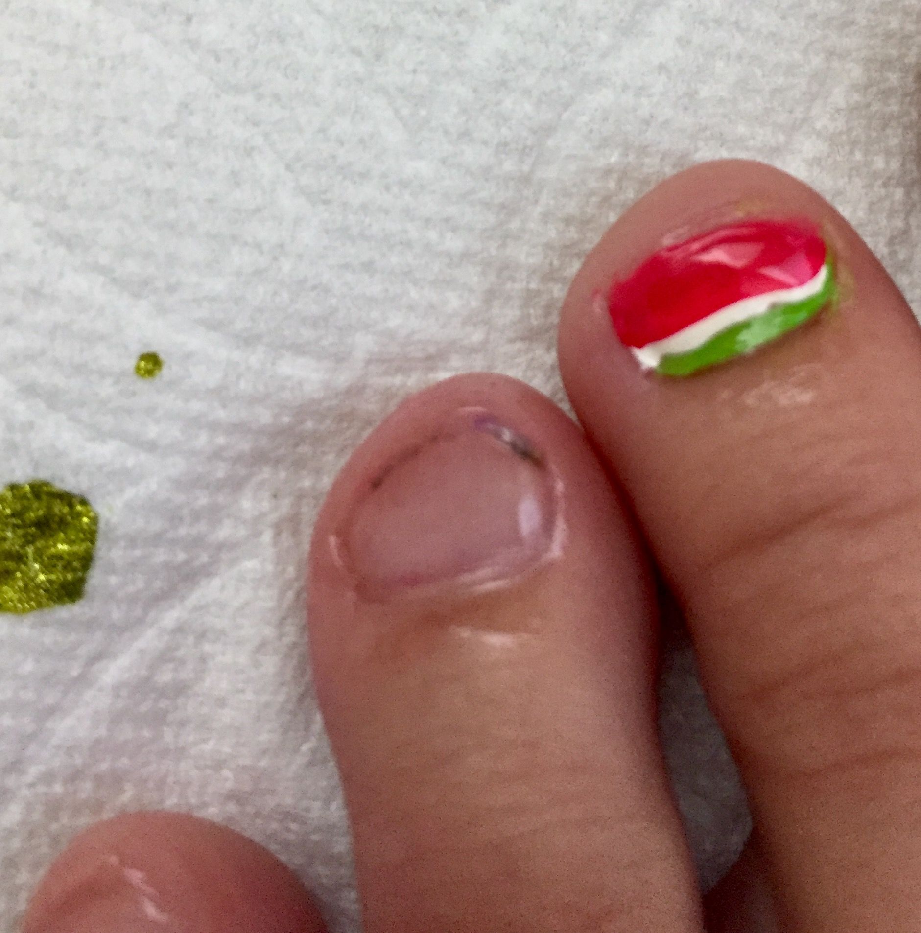 Summer Toenail Art - Beginner Nail Art : 9 Steps - Instructables