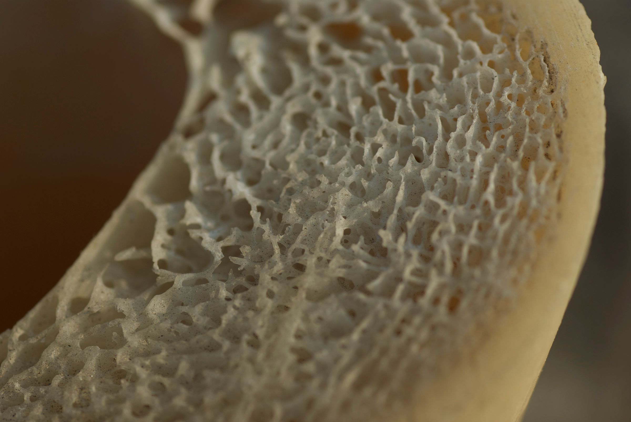 Celtic Knot Bone Ring : 9 Steps (with Pictures) - Instructables