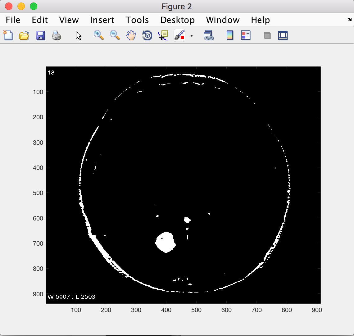 Isolating MRI Brain Tumor Using Matlab : 7 Steps - Instructables