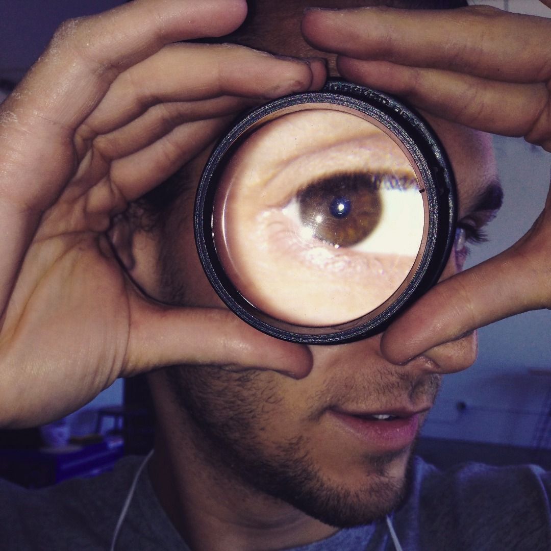 Smartphone Fundus Camera : 8 Steps (with Pictures) - Instructables