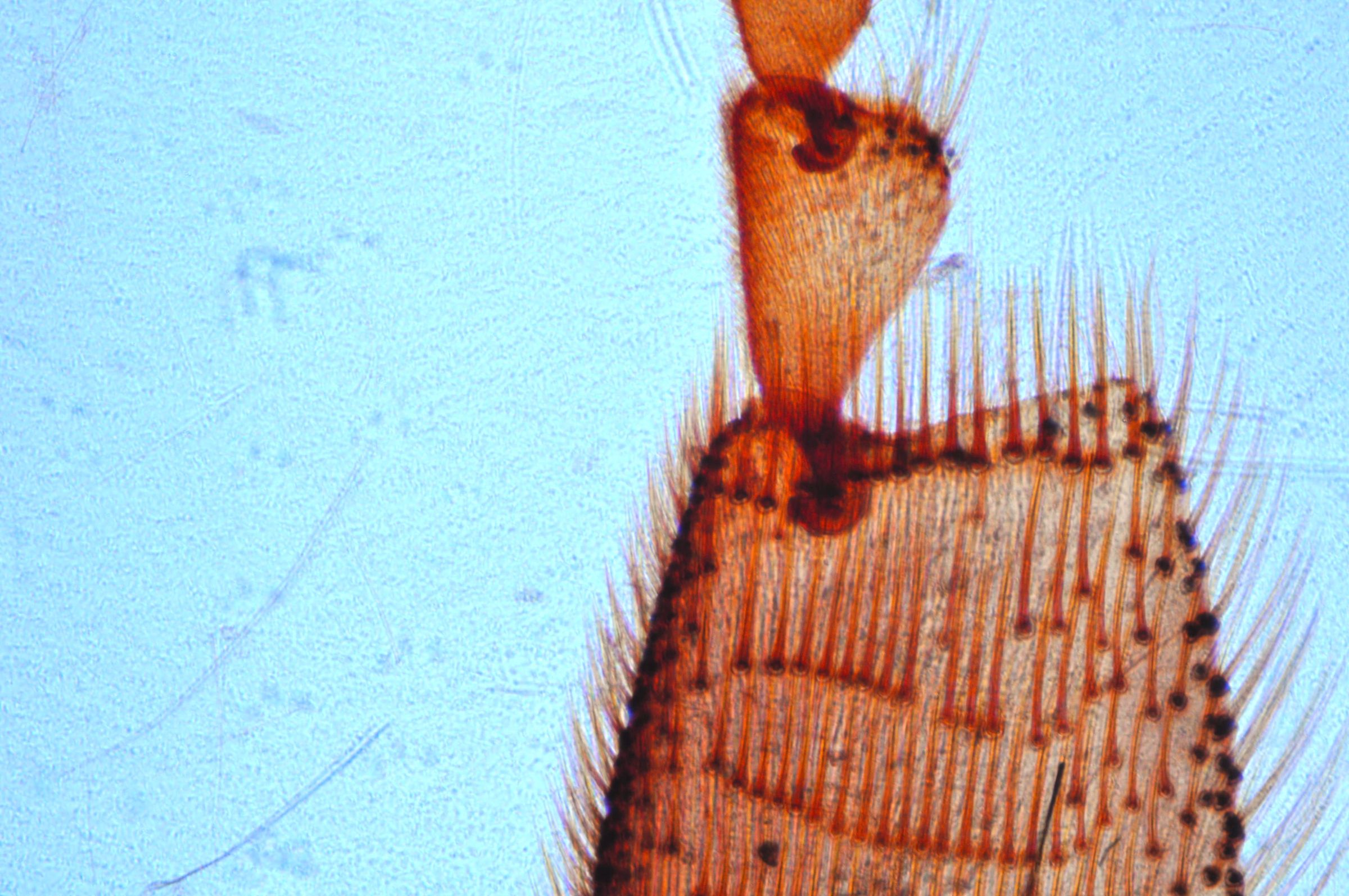 Low-cost Fluorescence and Brightfield Microscopes : 9 Steps (with ...