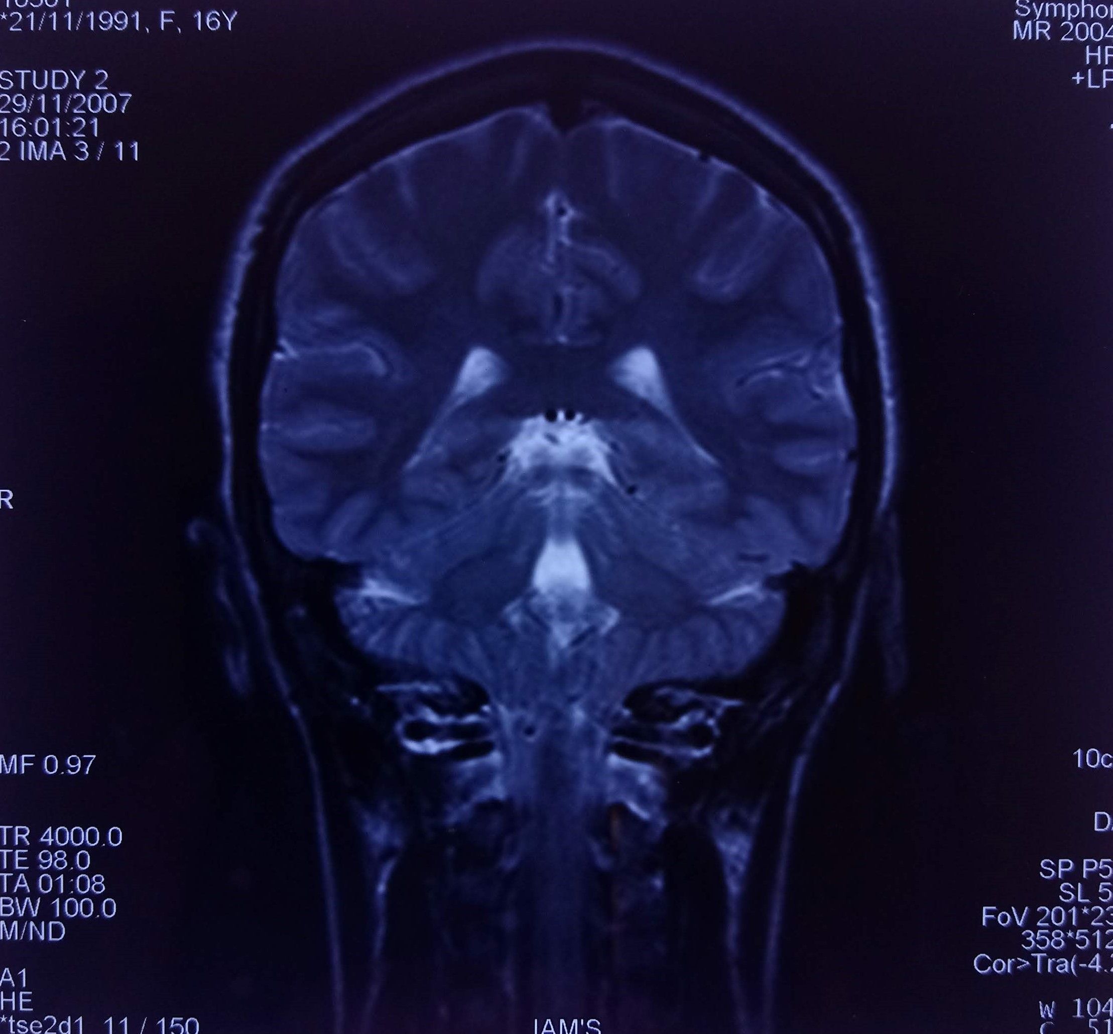 Mapping Your Mind- a Lesson on the Human Brain : 7 Steps - Instructables