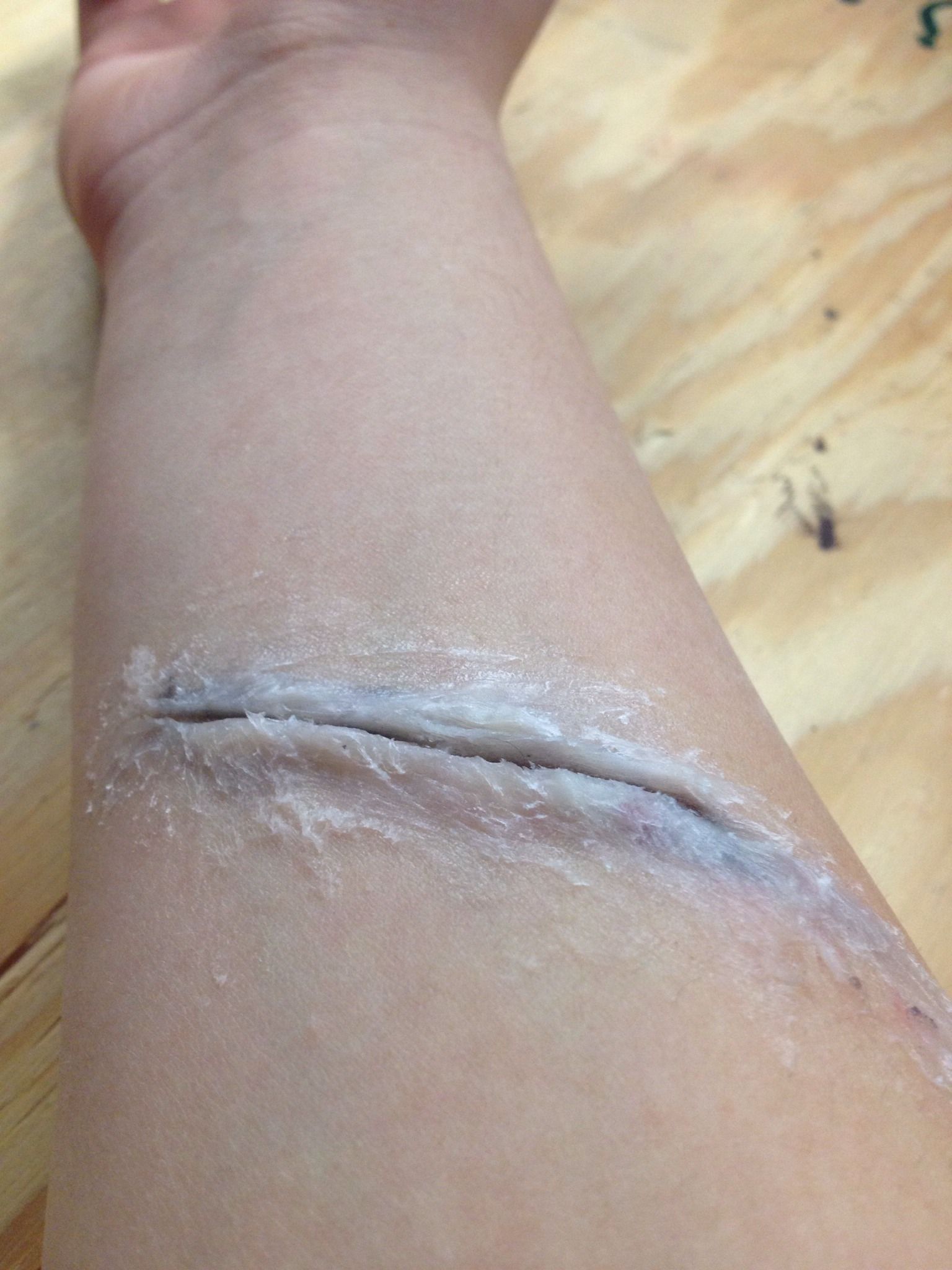 Special Effects Make Up: Scar : 8 Steps - Instructables