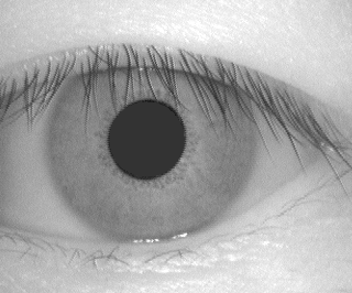 Iris Detection : 5 Steps (with Pictures) - Instructables