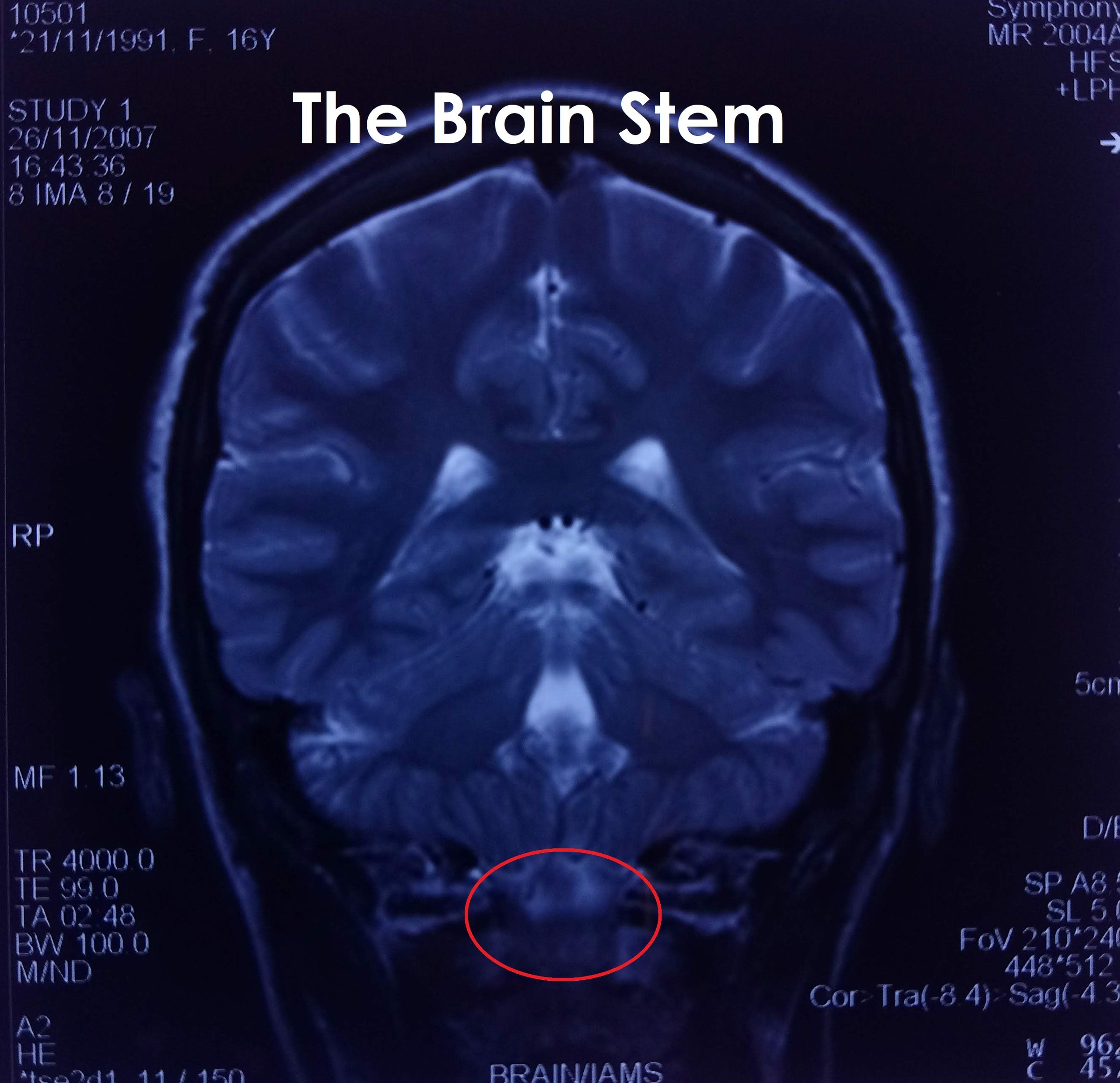Mapping Your Mind- a Lesson on the Human Brain : 7 Steps - Instructables