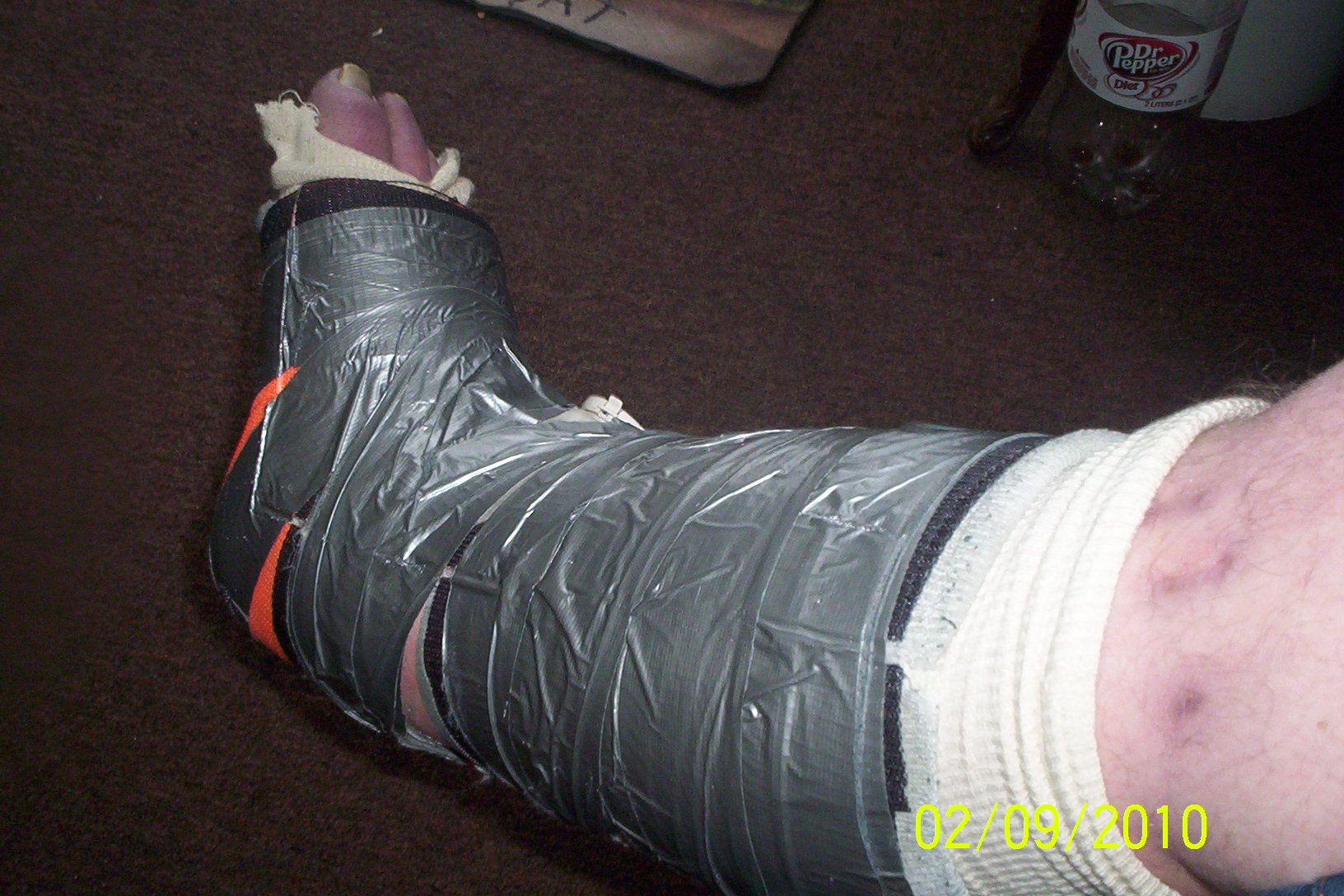 Holding Leg Cast Together - Instructables