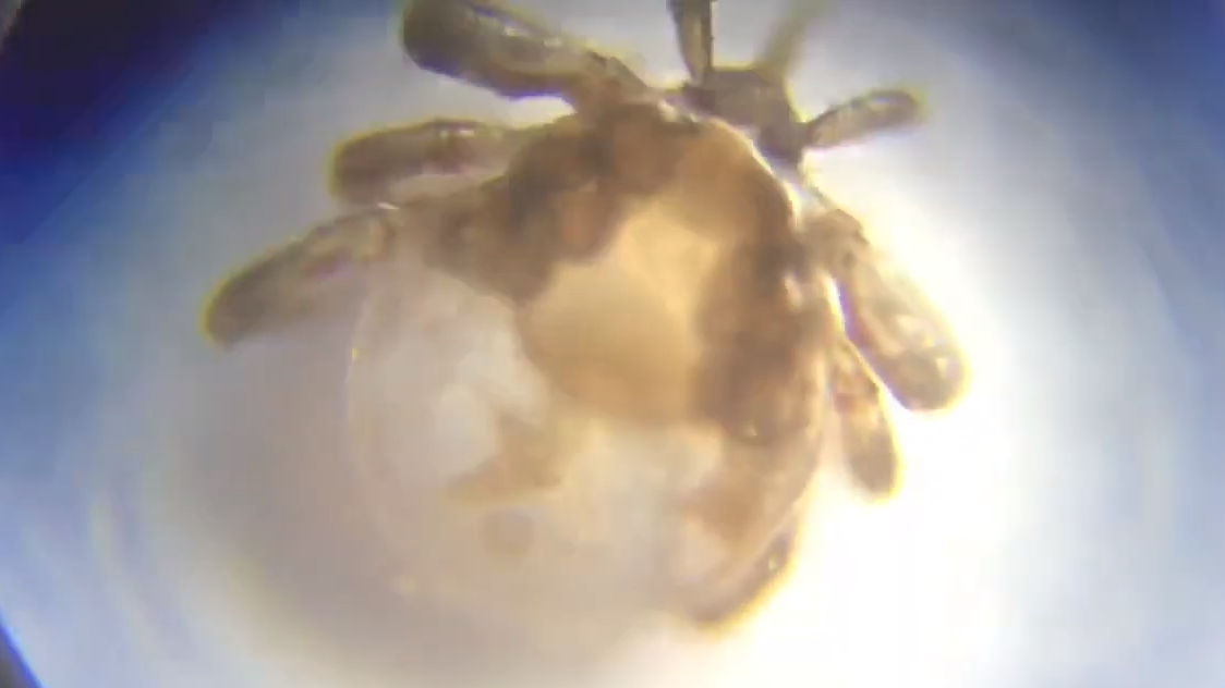 How SMALL Are Deer Ticks and How to PROTECT Ourselves From Them (lyme ...