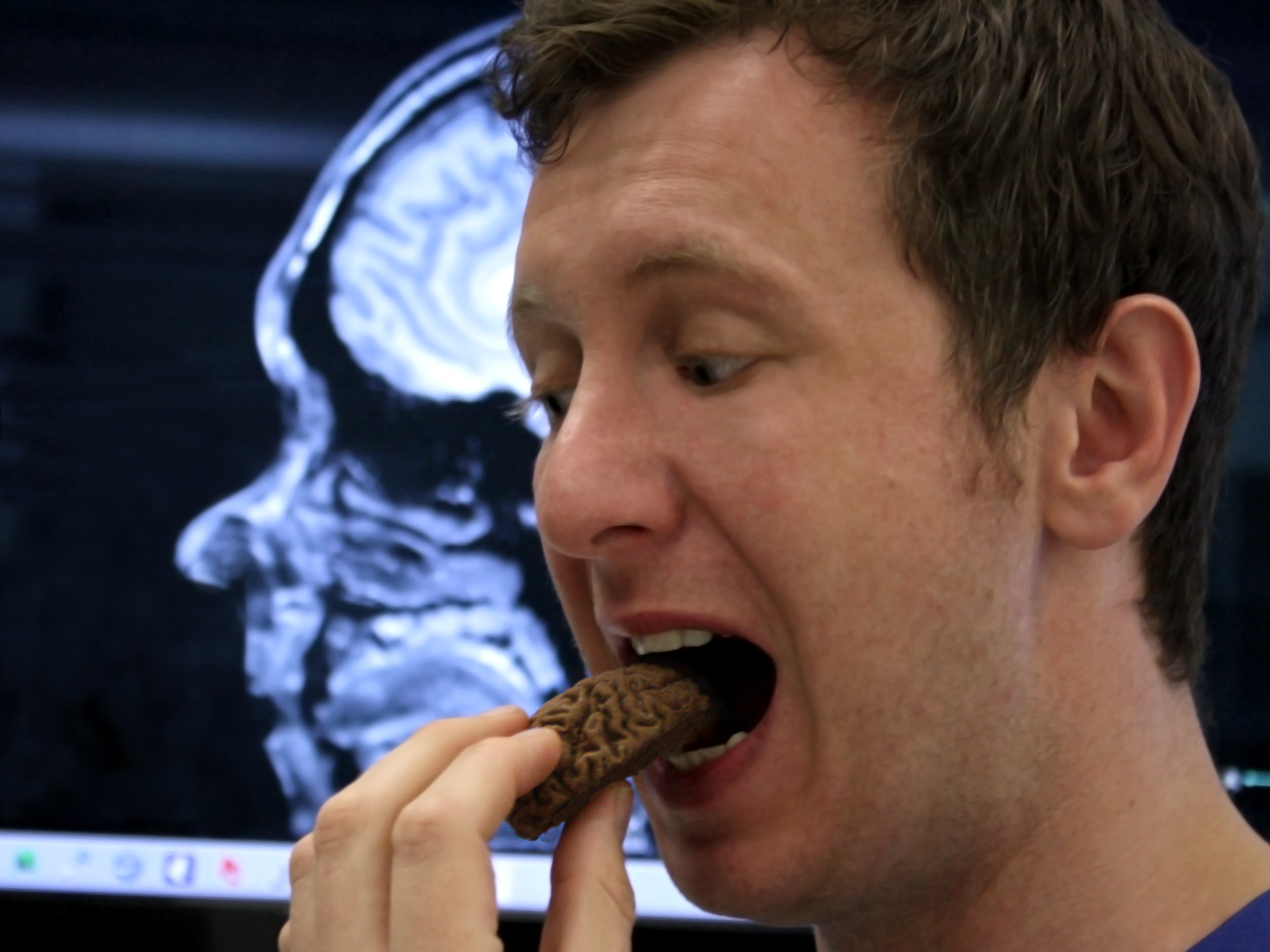 Edible Chocolate Brain From MRI Scan : 9 Steps (with Pictures ...