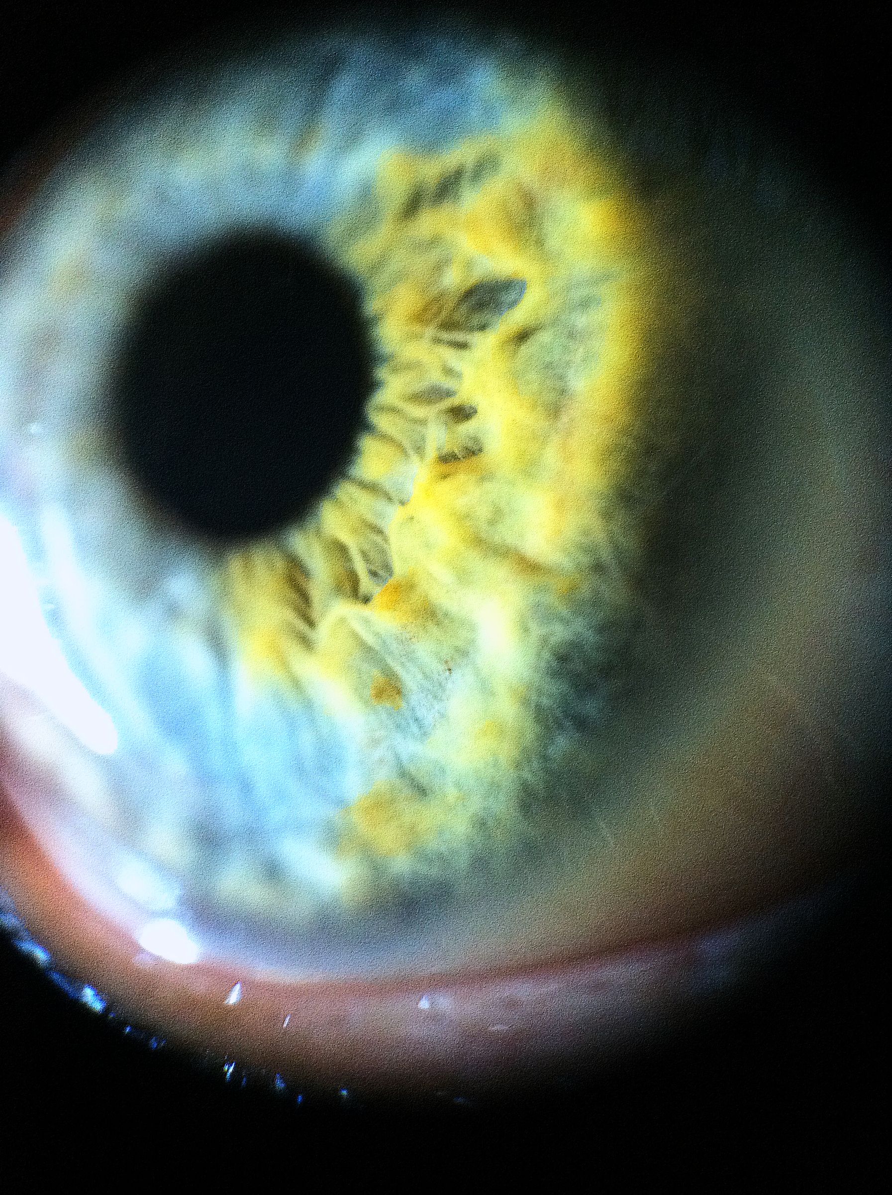 How to Make a Very Effective and Cheap Micro/macro Lens for an IPhone ...