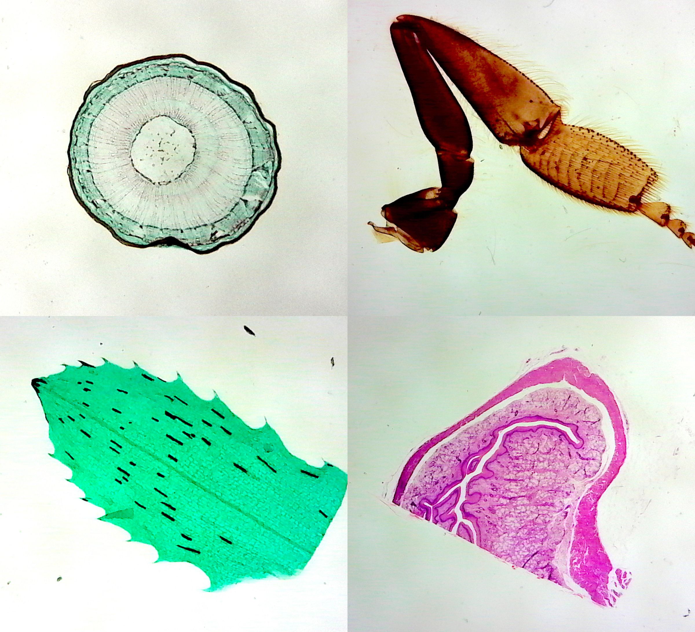 Low-cost Fluorescence and Brightfield Microscopes : 9 Steps (with ...