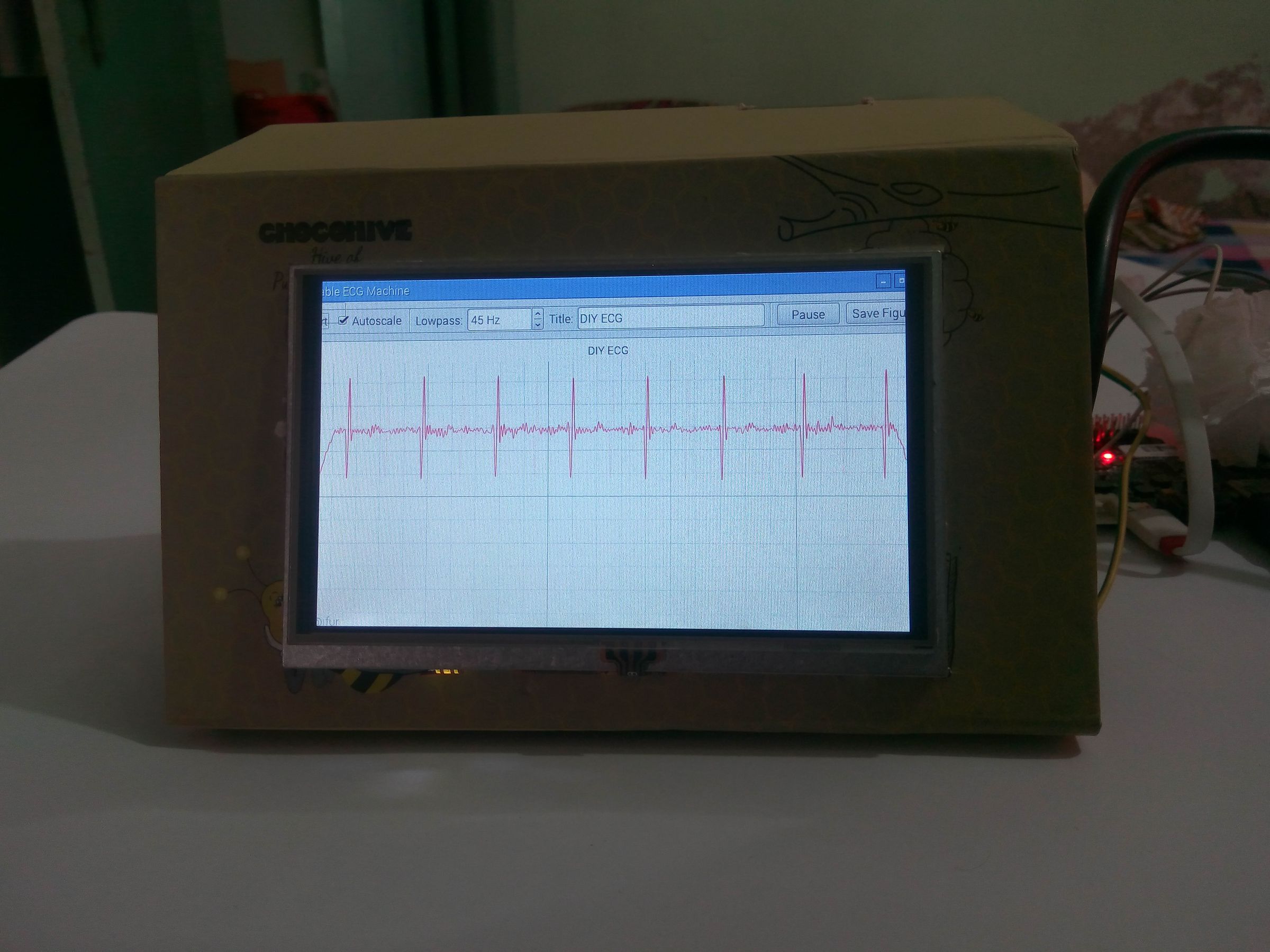 Portable ECG Machine : 9 Steps (with Pictures) - Instructables