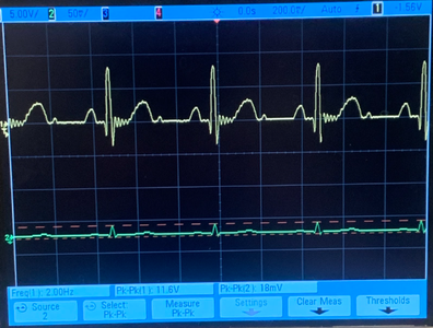 Designing a Functional ECG With Arduino Output : 7 Steps - Instructables