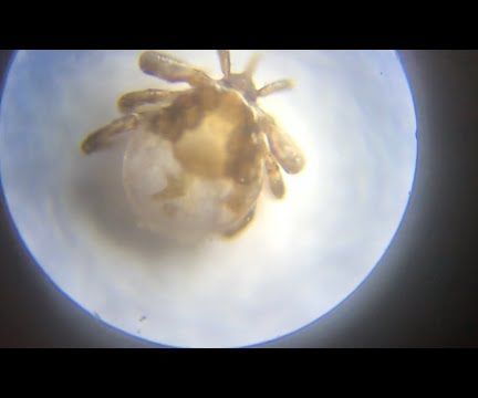How SMALL Are Deer Ticks and How to PROTECT Ourselves From Them (lyme ...