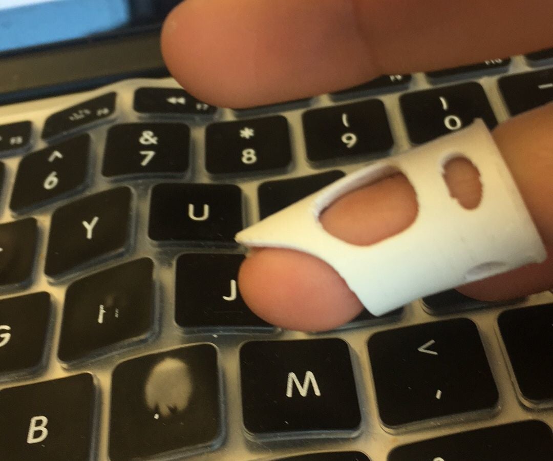 Custom 3D Printed Finger Splint : 3 Steps (with Pictures) - Instructables