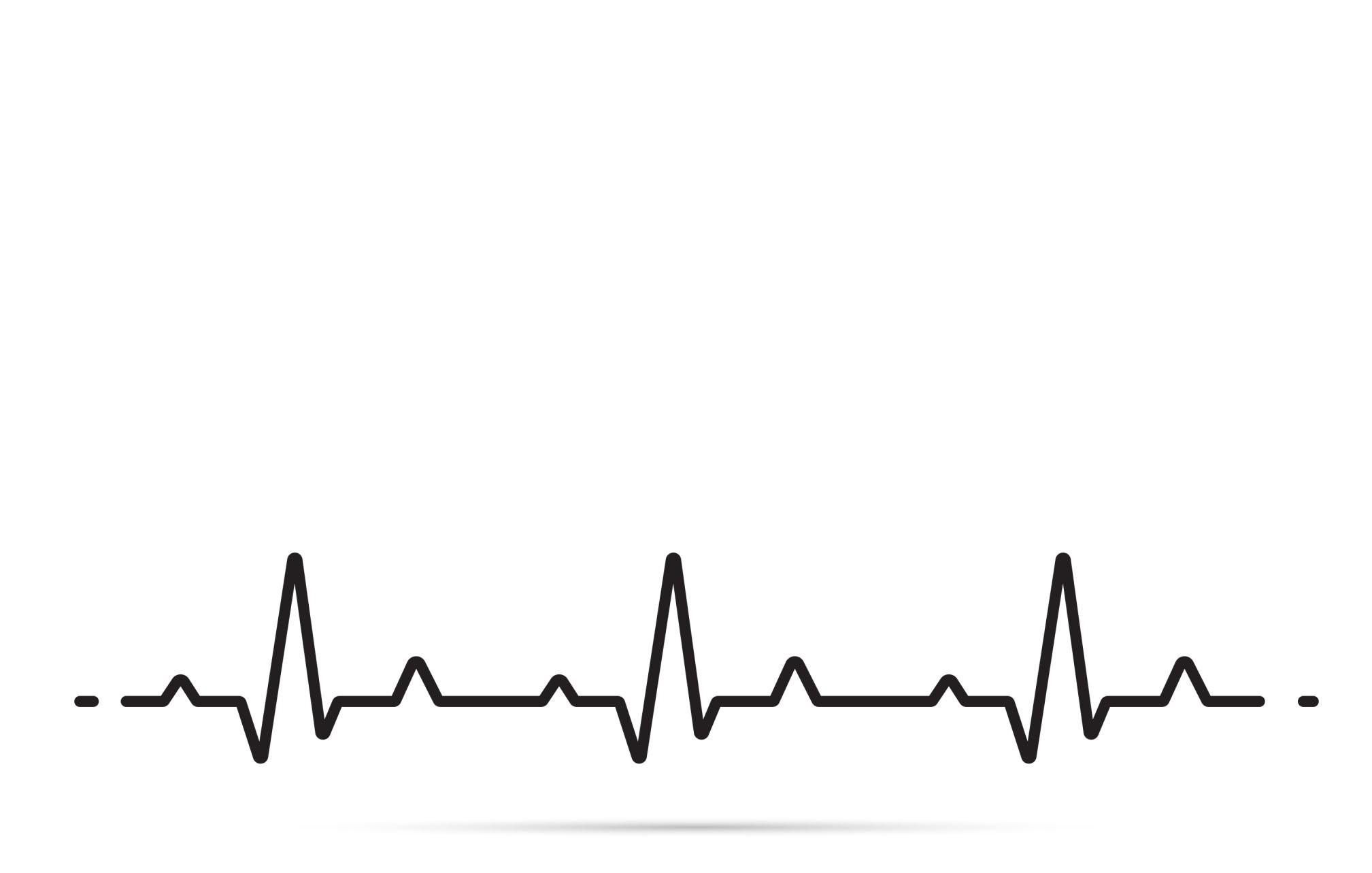 The Do-It-Yourself Electrocardiogram (ECG) : 6 Steps - Instructables