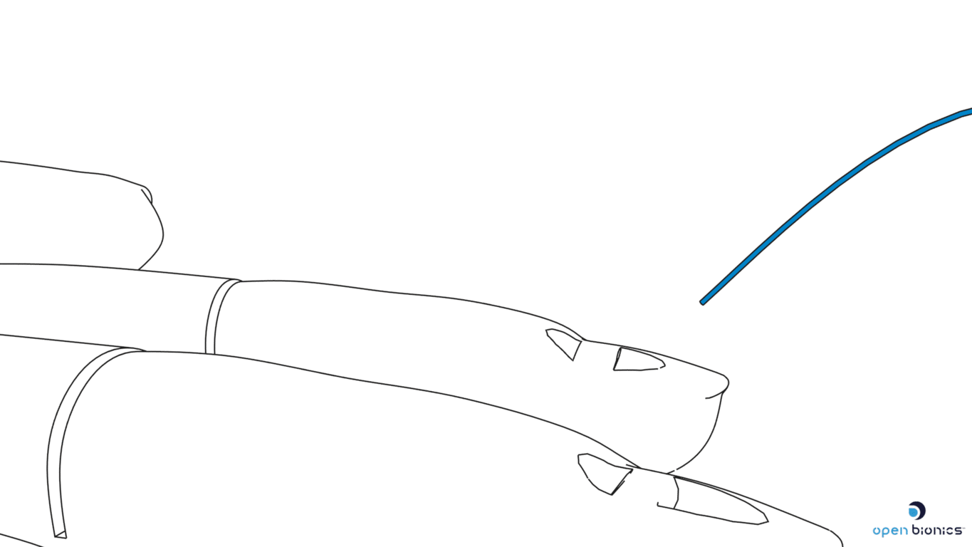 Ada Robotic Hand - Open Bionics : 8 Steps (with Pictures) - Instructables