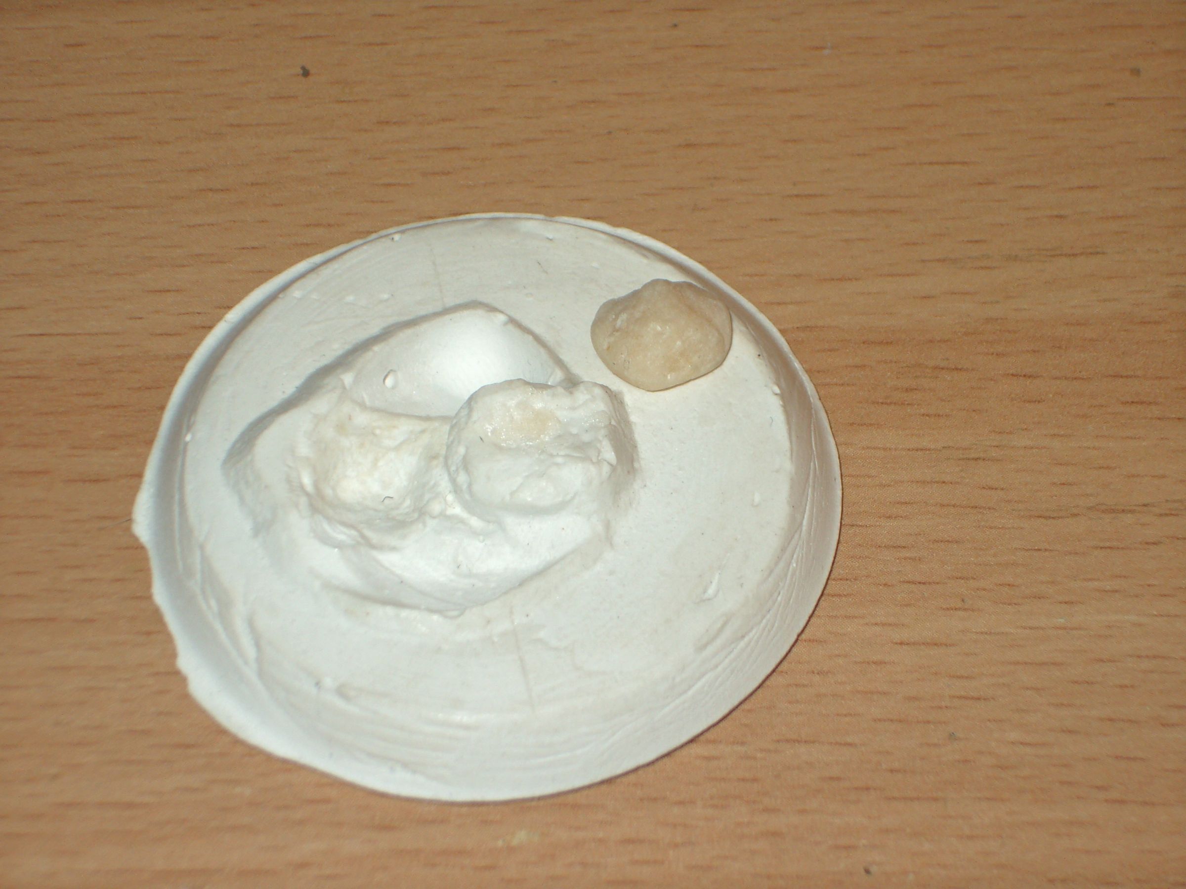 DIY Dentistry : 5 Steps - Instructables